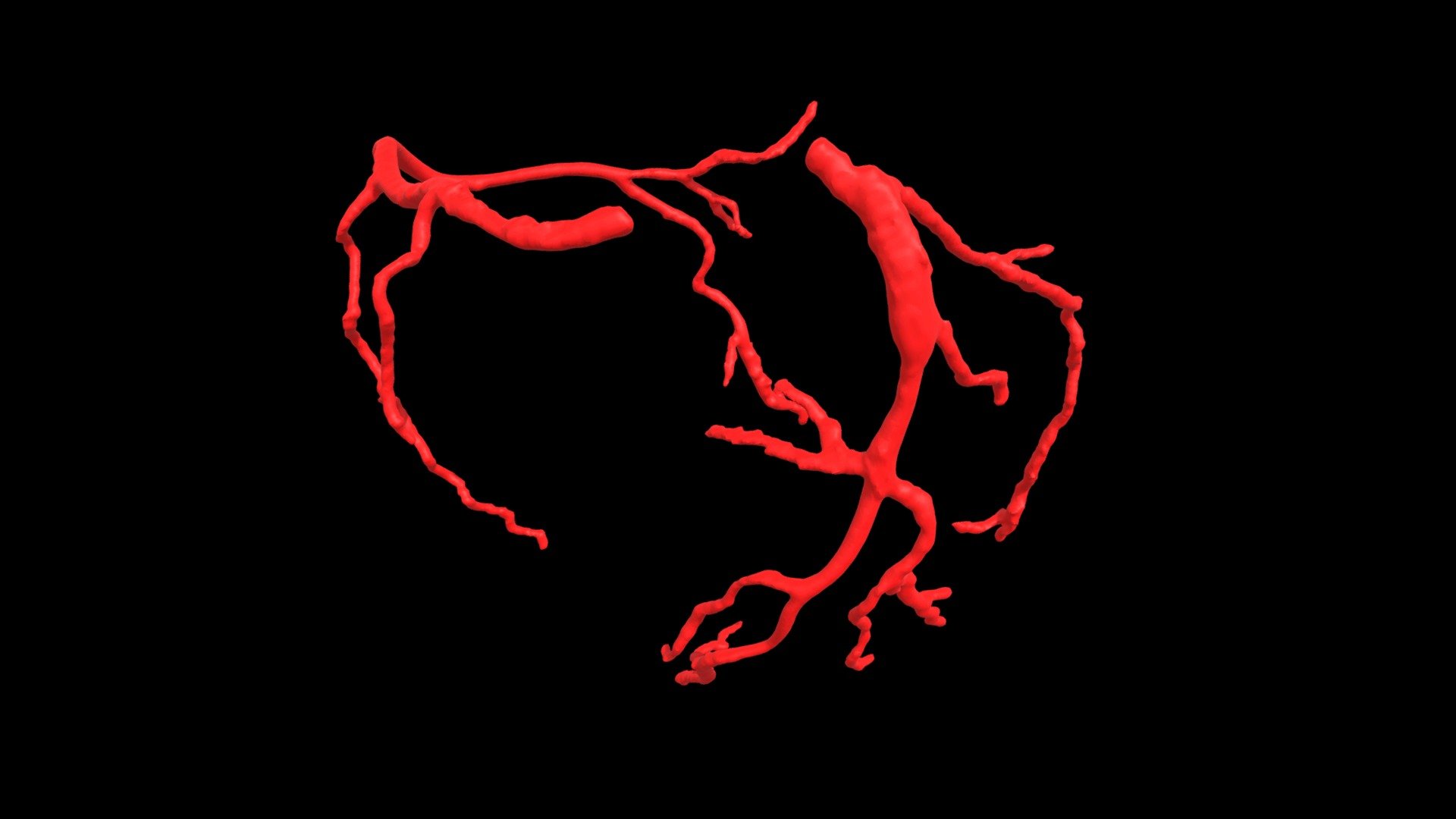 Heart0063 Coronary Arteries - Download Free 3D model by ...