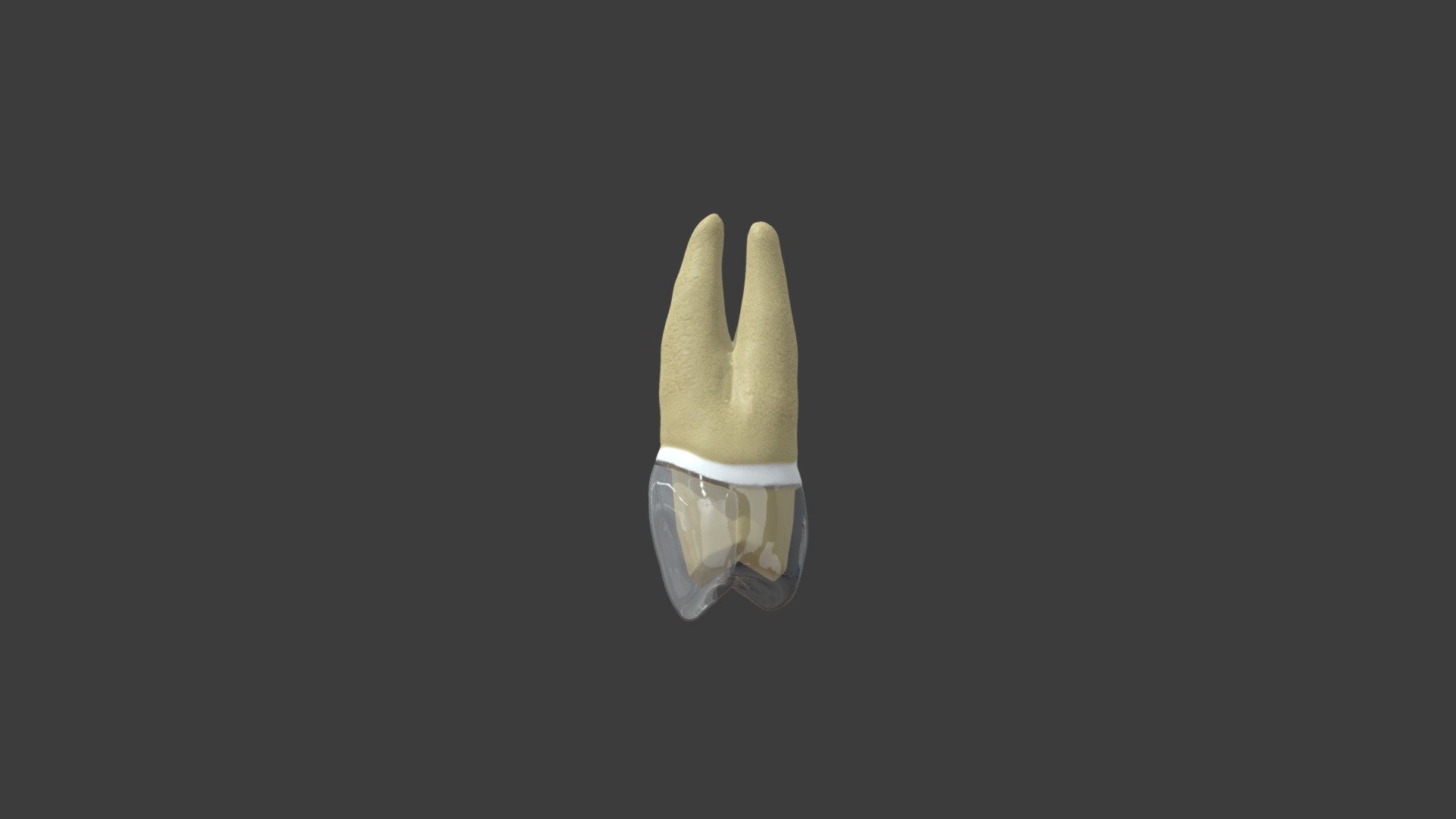 premolar transparent - 3D model by Ahmed Mahrous (@drahedmahrous ...