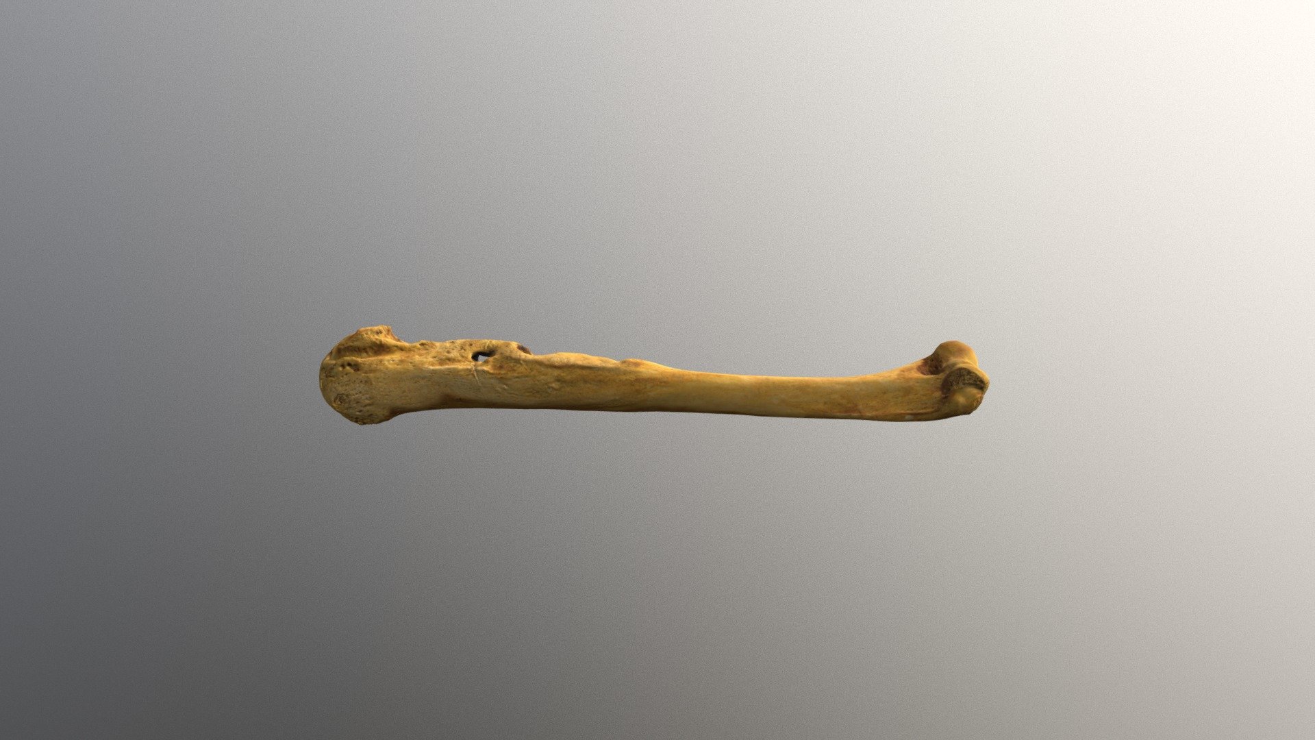 Osteomyelitis - Right Humerus - 3D model by BU Forensic Anthropology ...