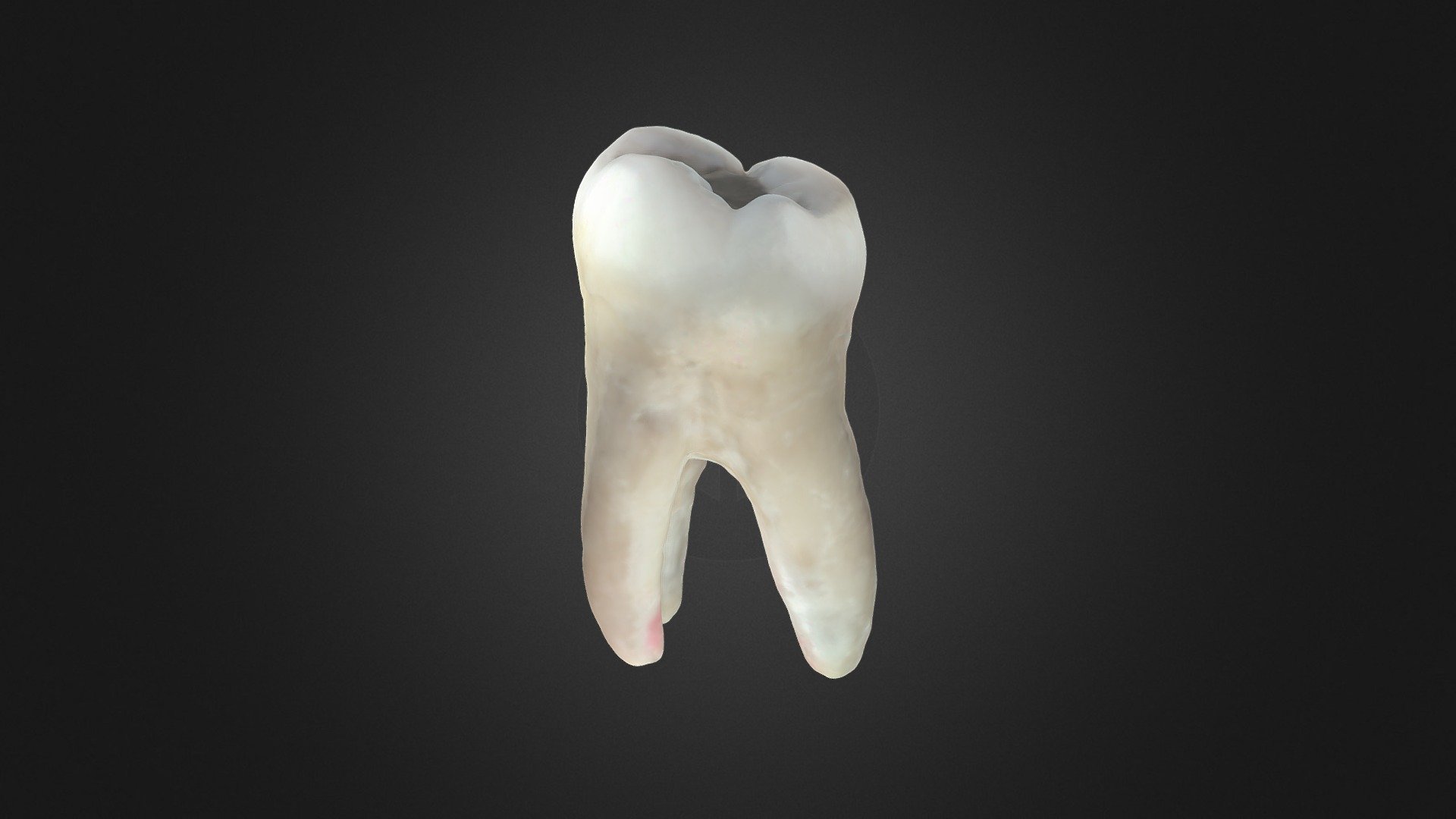 Dente 37 - Lower Left Second Molar (ID 37a) - Download Free 3D model by ...
