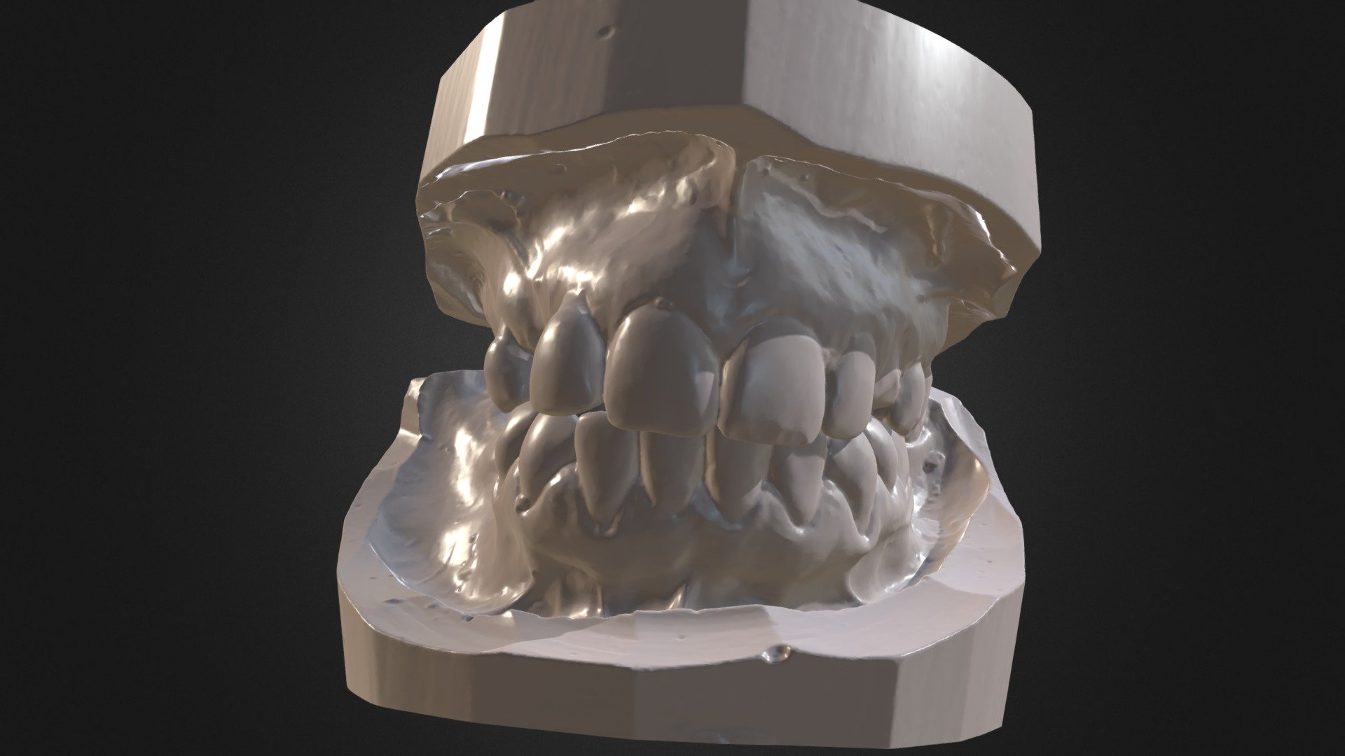 Case CC Occlusion - Download Free 3D model by mdentalmargeaux [86155ef ...