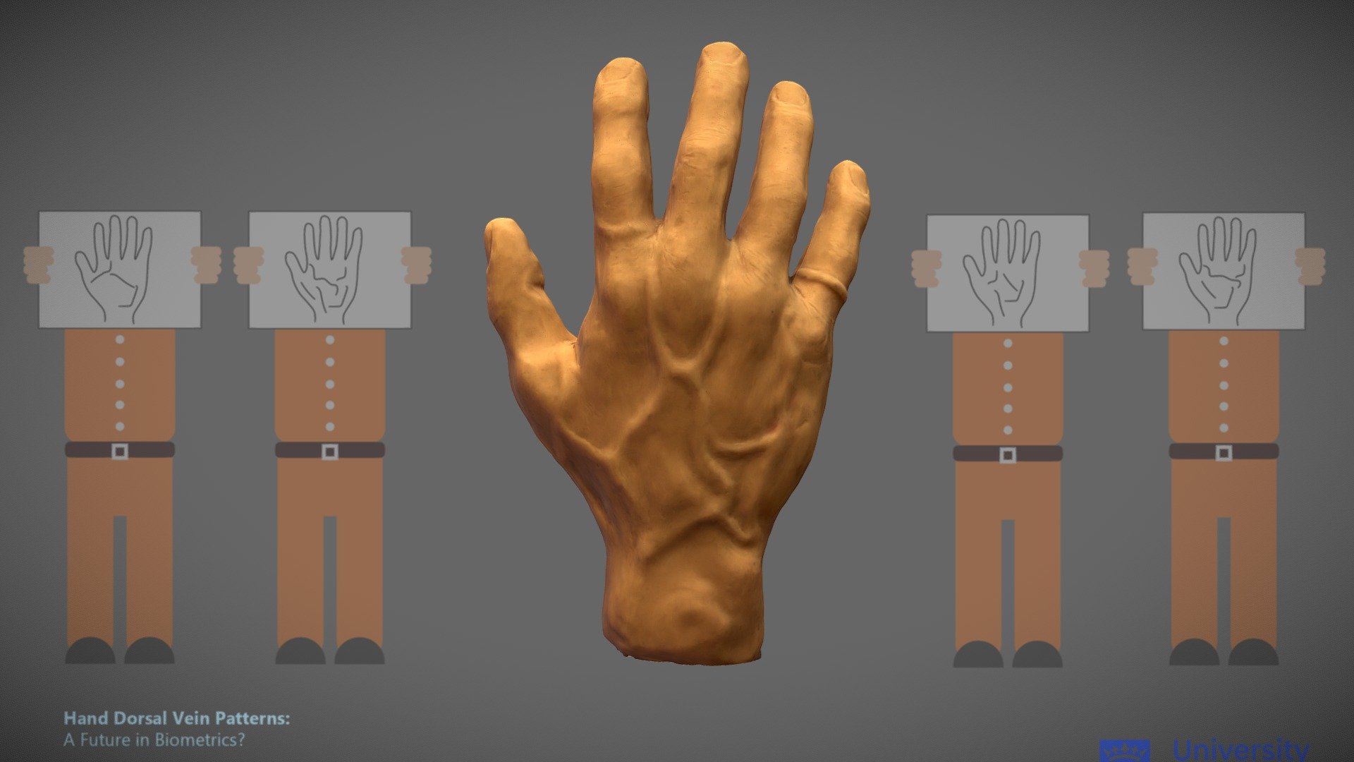 Hand Dorsal Vein Patterns: Unique and Useful - 3D model by University ...