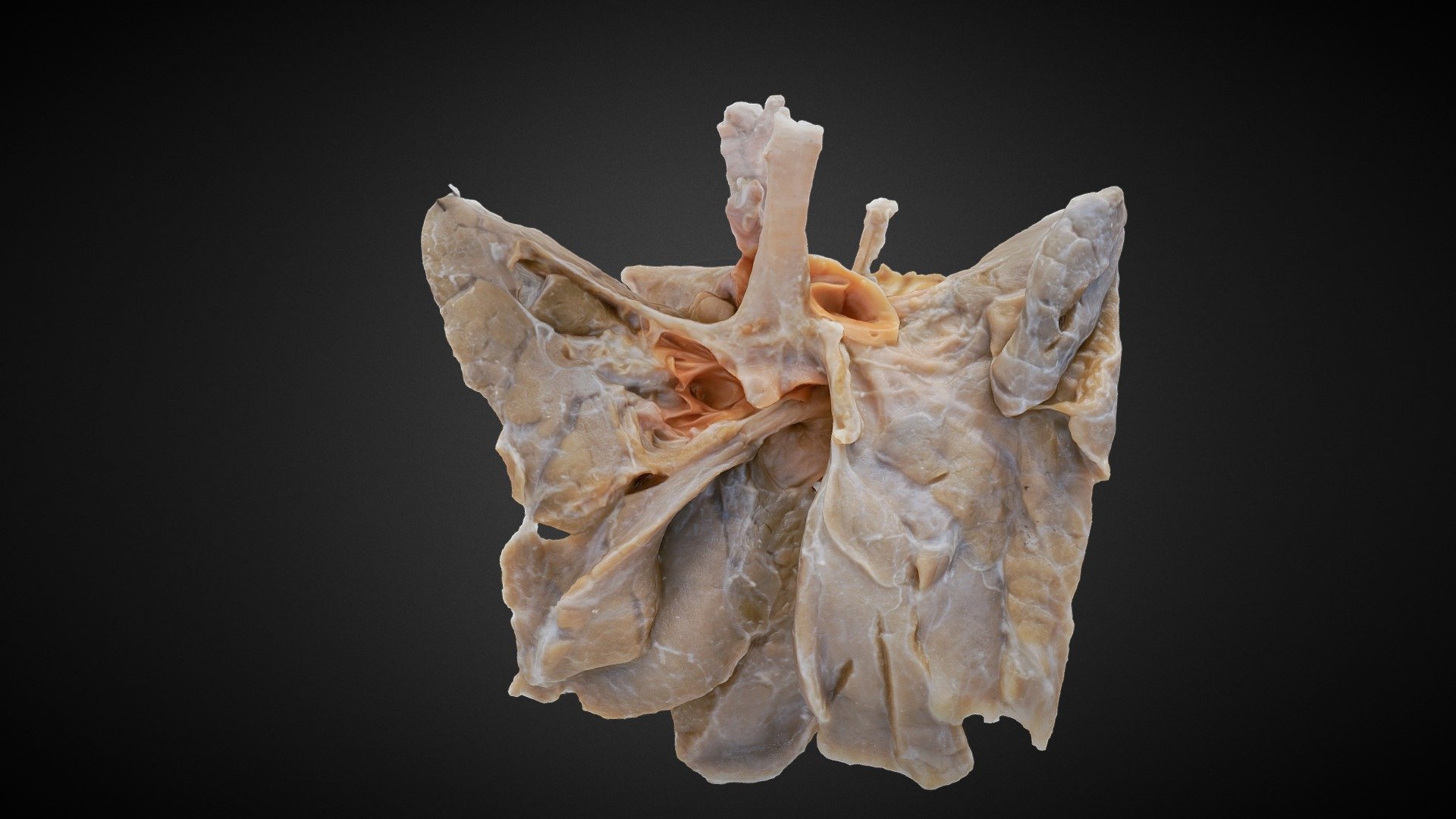 100_hi_res - 3D model by CHOP Cardiac Specimens (@cardiacspecimens ...