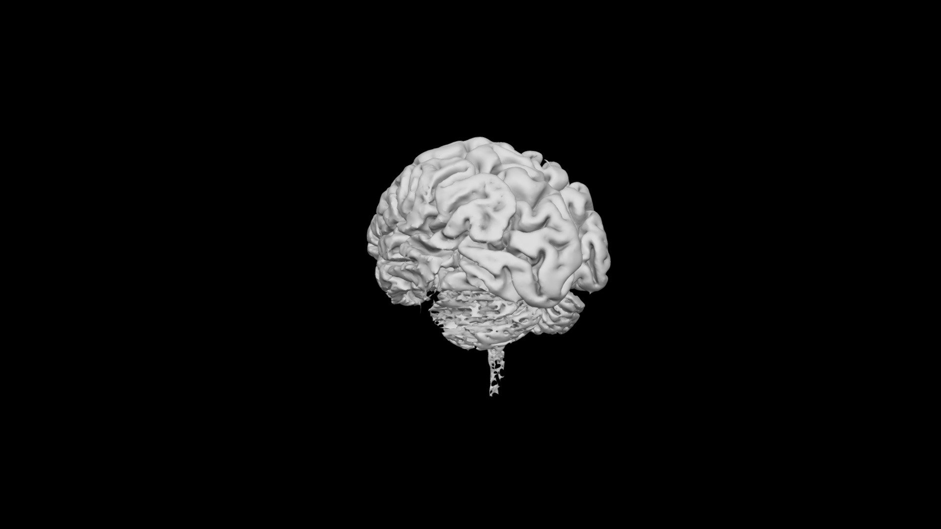 Segmentation Brain 3d Model By Omachi707 [87644c1] Sketchfab