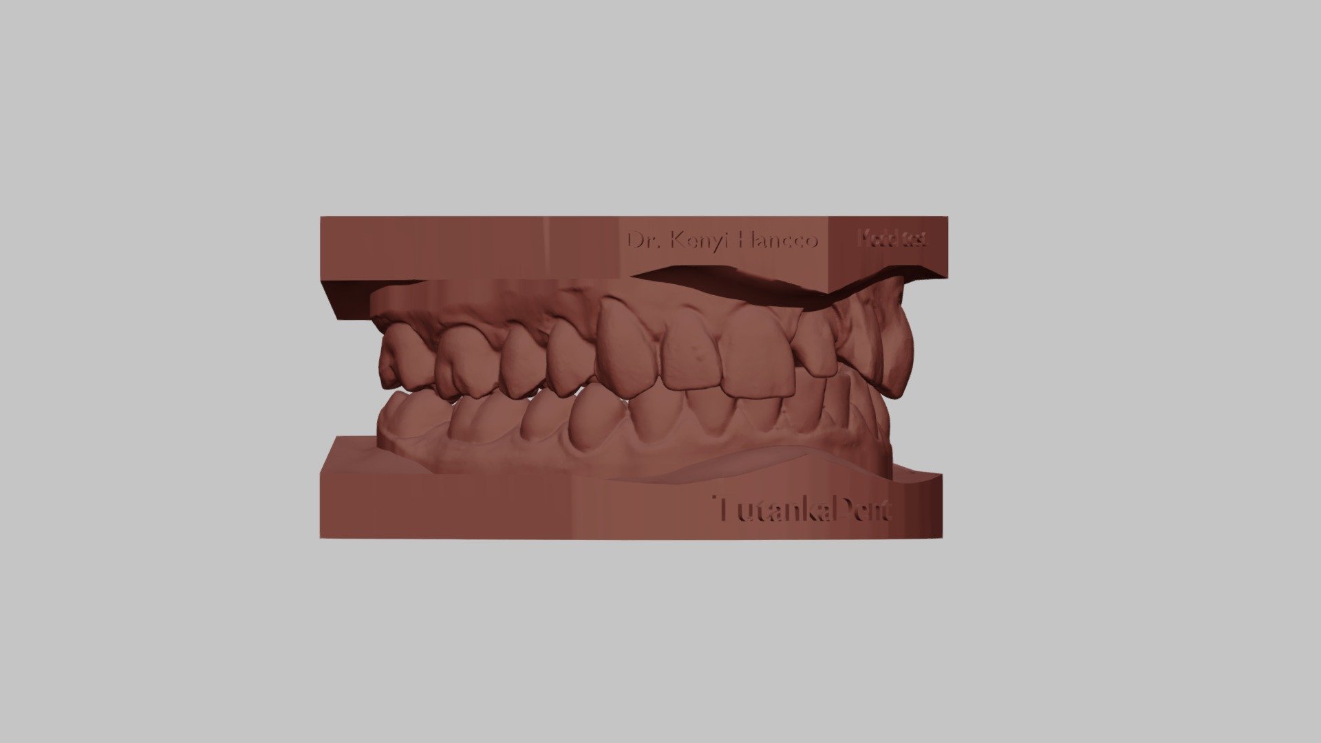 Dental model for 3D print - Download Free 3D model by kenyihancco ...