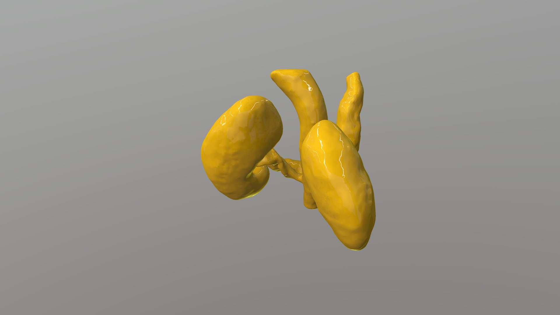 Segmented Kidney Model - 3D model by Davis.Fay [87d04c1] - Sketchfab