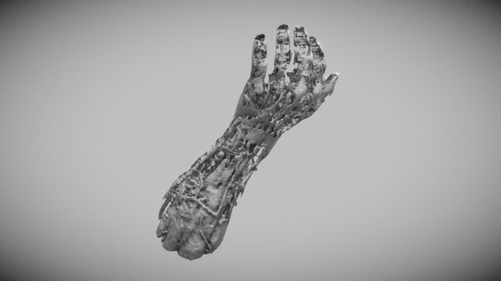 Arm - 3D model by Wellness Computational (@wellnesscomputational ...