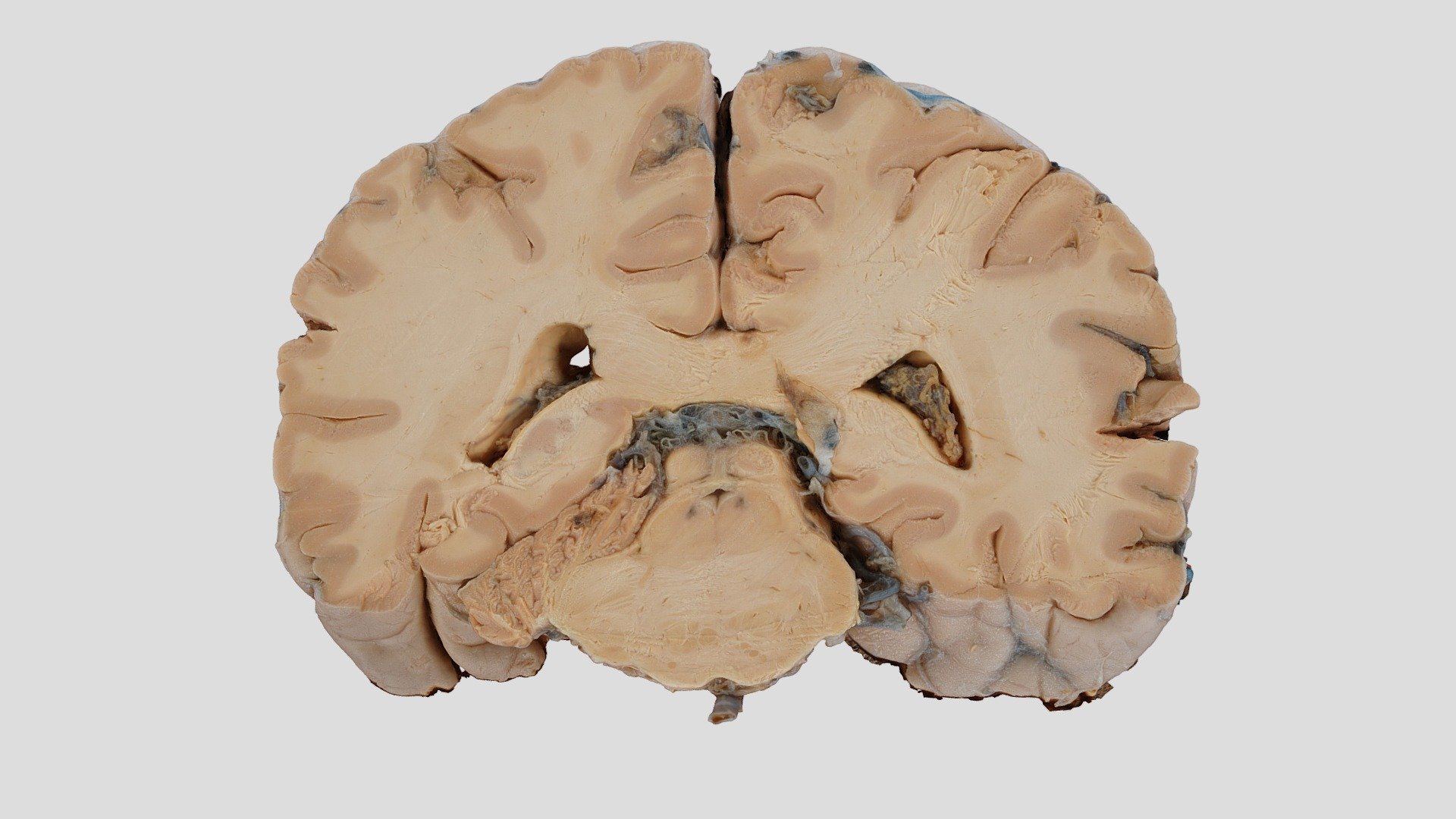 Frontal 7B - 3D model by kucharm [8858cc8] - Sketchfab