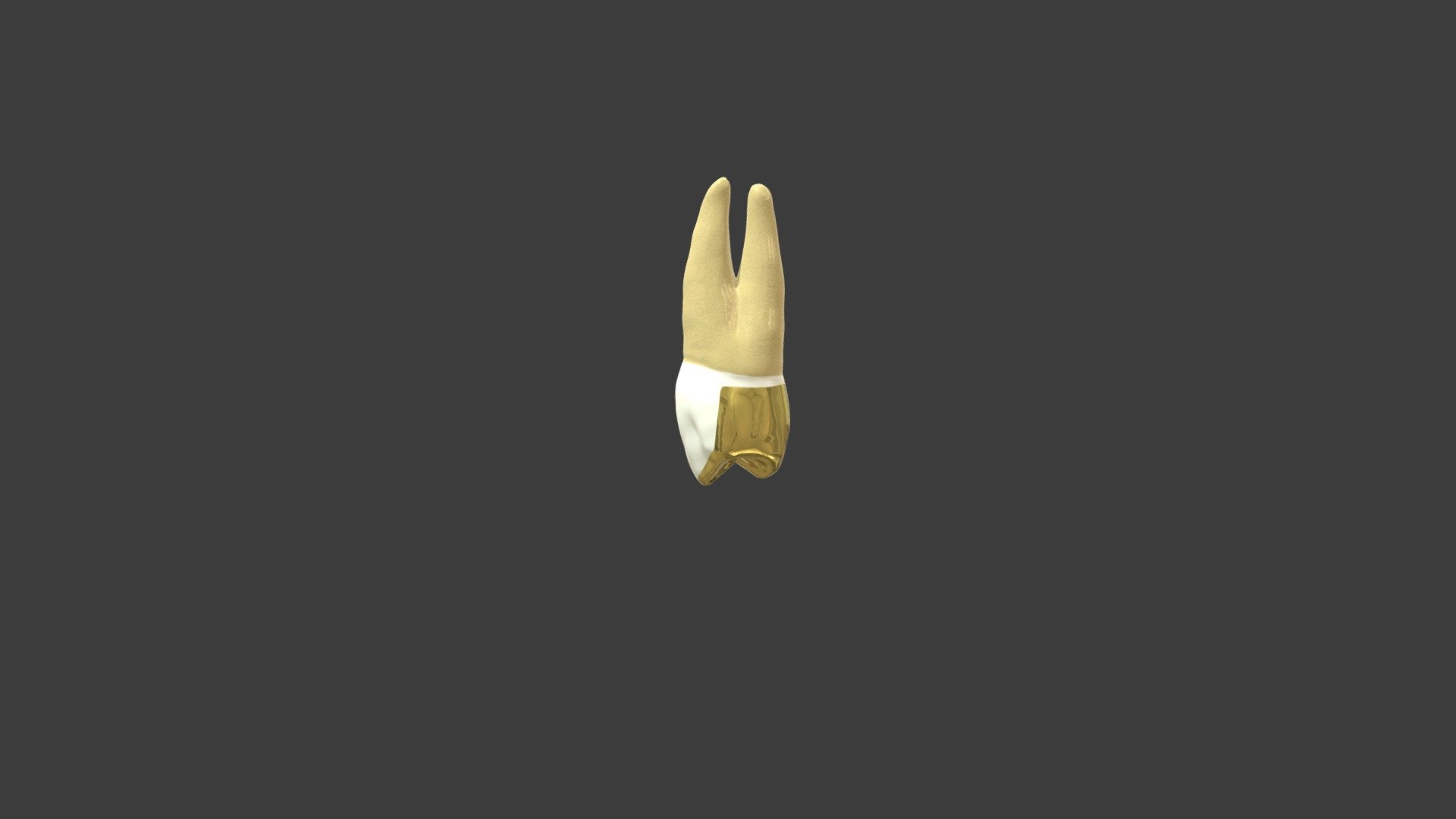 Three fourths Crown Gold - 3D model by Ahmed Mahrous (@drahedmahrous ...