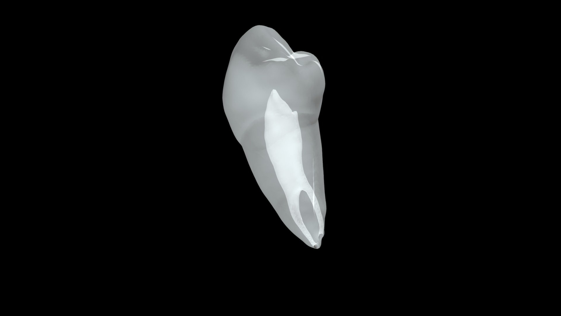 Tooth 28 - 3D model by biomed3d [88bf0ff] - Sketchfab