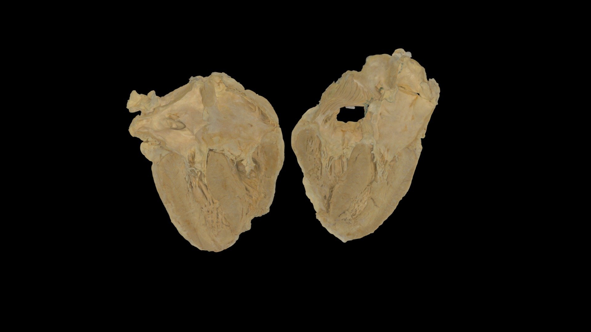 Plastinated Human Heart #0058 - Download Free 3D model by ...