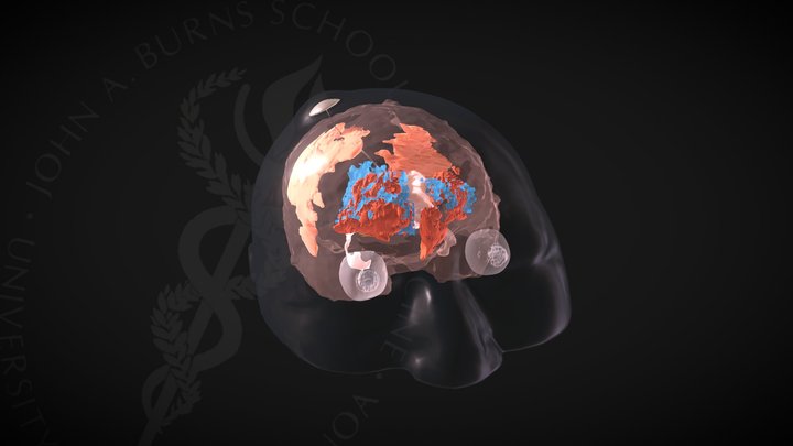 Shunt 3D models - Sketchfab