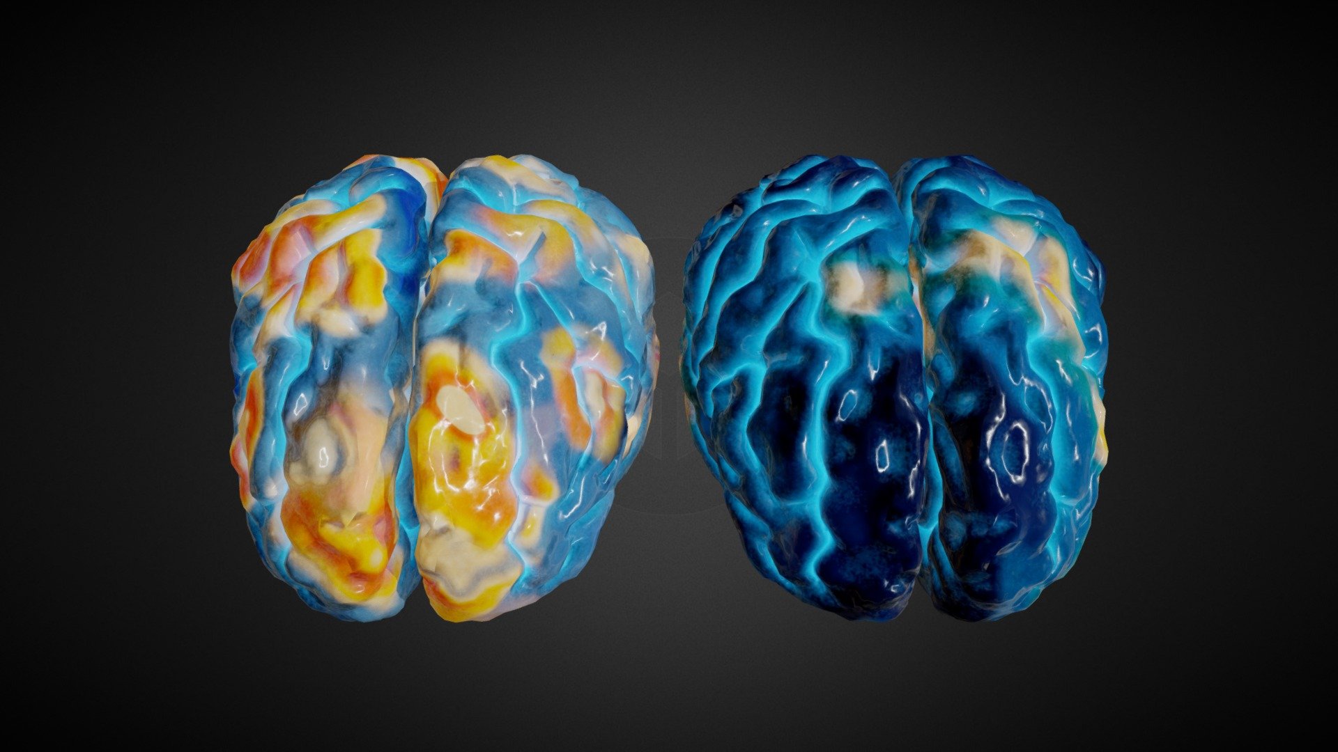 3_Depression - 3D model by Vida Systems (@objects1) [89bdabe] - Sketchfab
