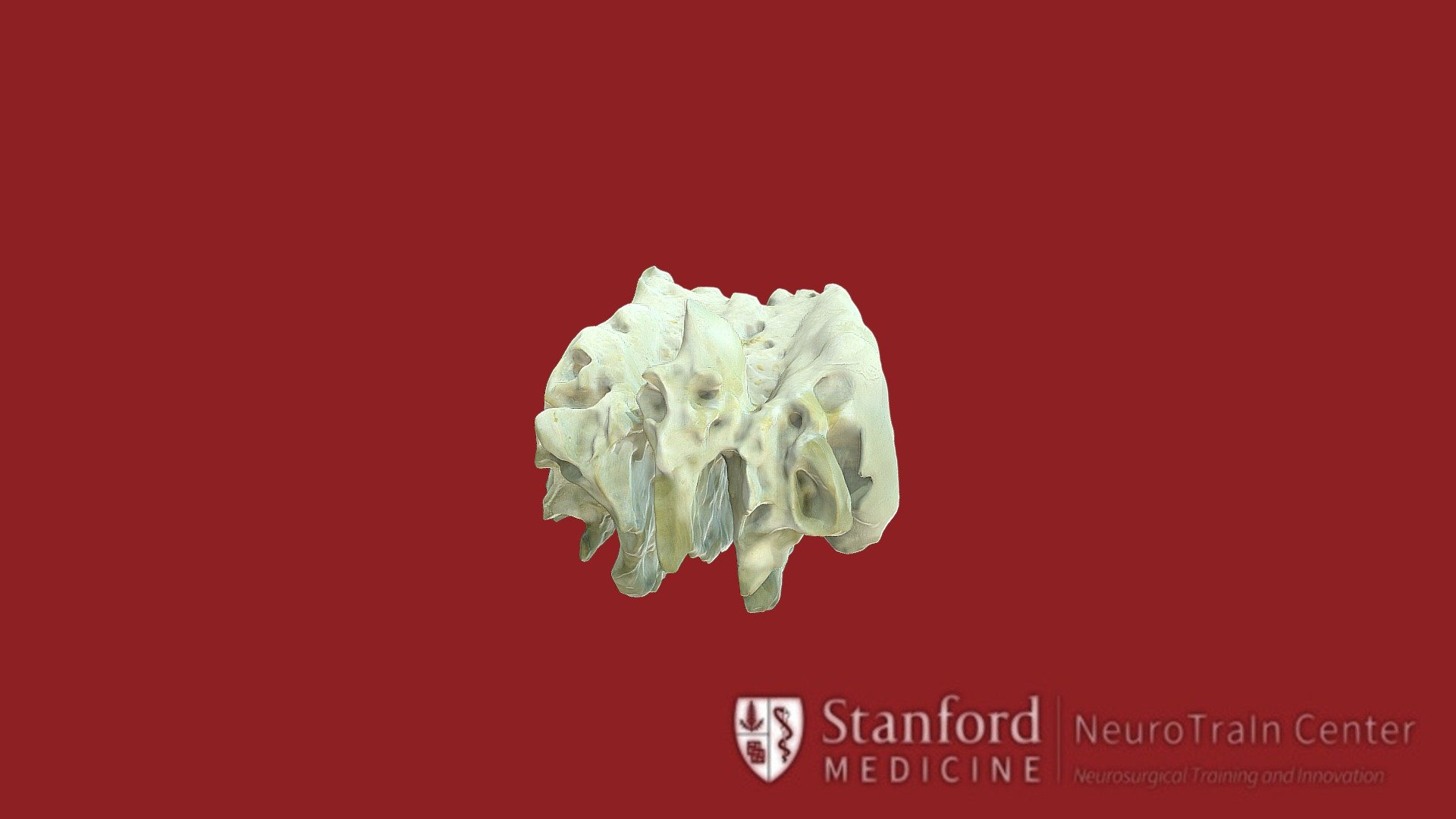 Ethmoid Bone - 3D model by vv (@verav) [89fa2ef] - Sketchfab
