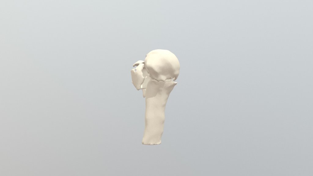 3-Part Fracture - 3D model by E-LISA [8a24ca1] - Sketchfab