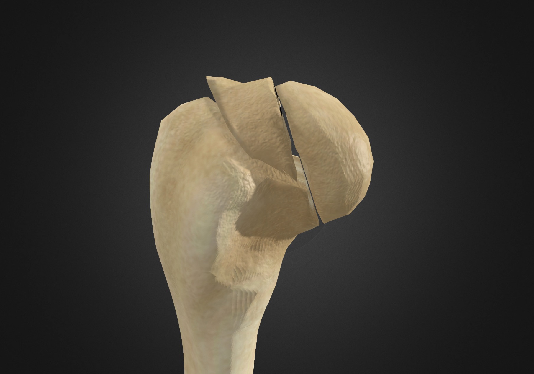 11-C2.3 - 3D model by ORS (@hovahealth) [8a37b2d] - Sketchfab