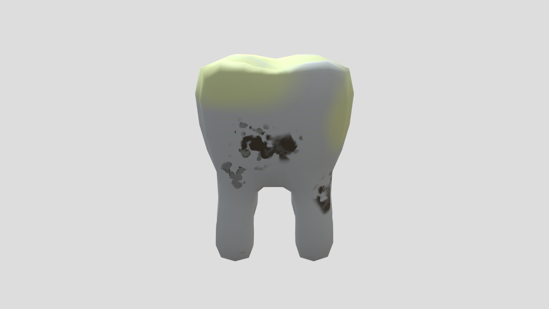Tooth - 3D model by Jessica Livingstone (@jessicalivingstone) [8b02139 ...