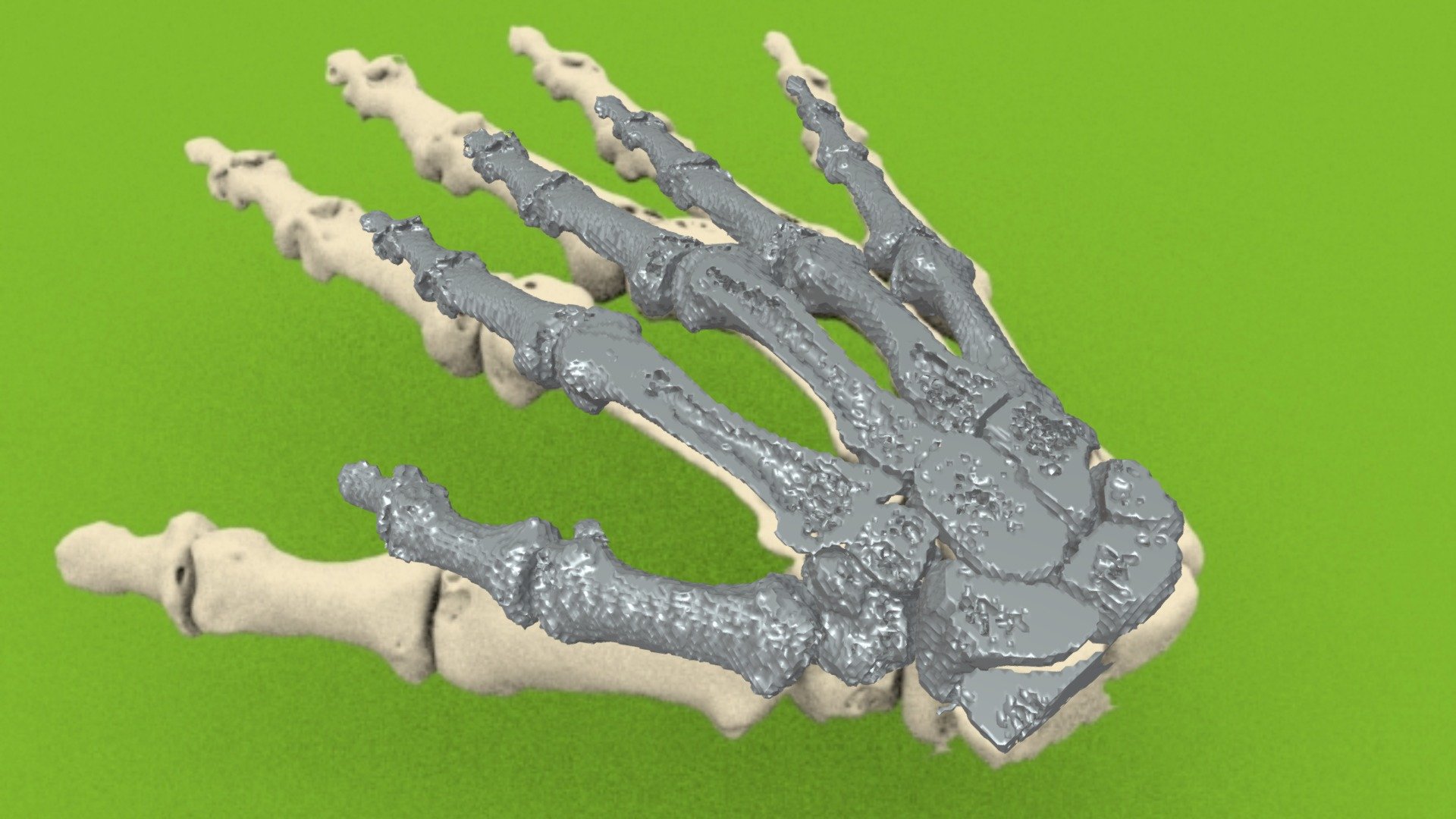 Articulated CT Scan Of Hand - 3D model by Interactive 3D Data ...