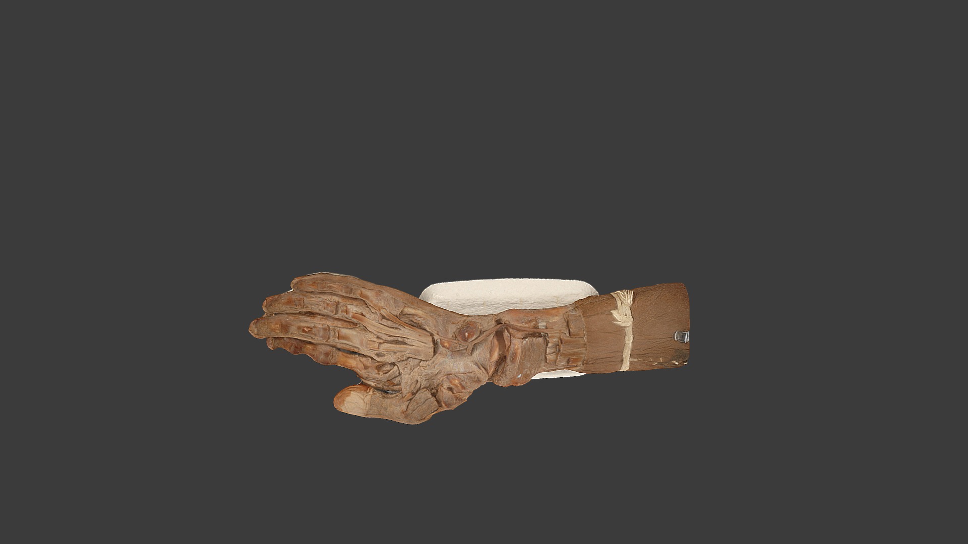 Dissection: Palmar Aspect of Hand with Forearm - 3D model by ...