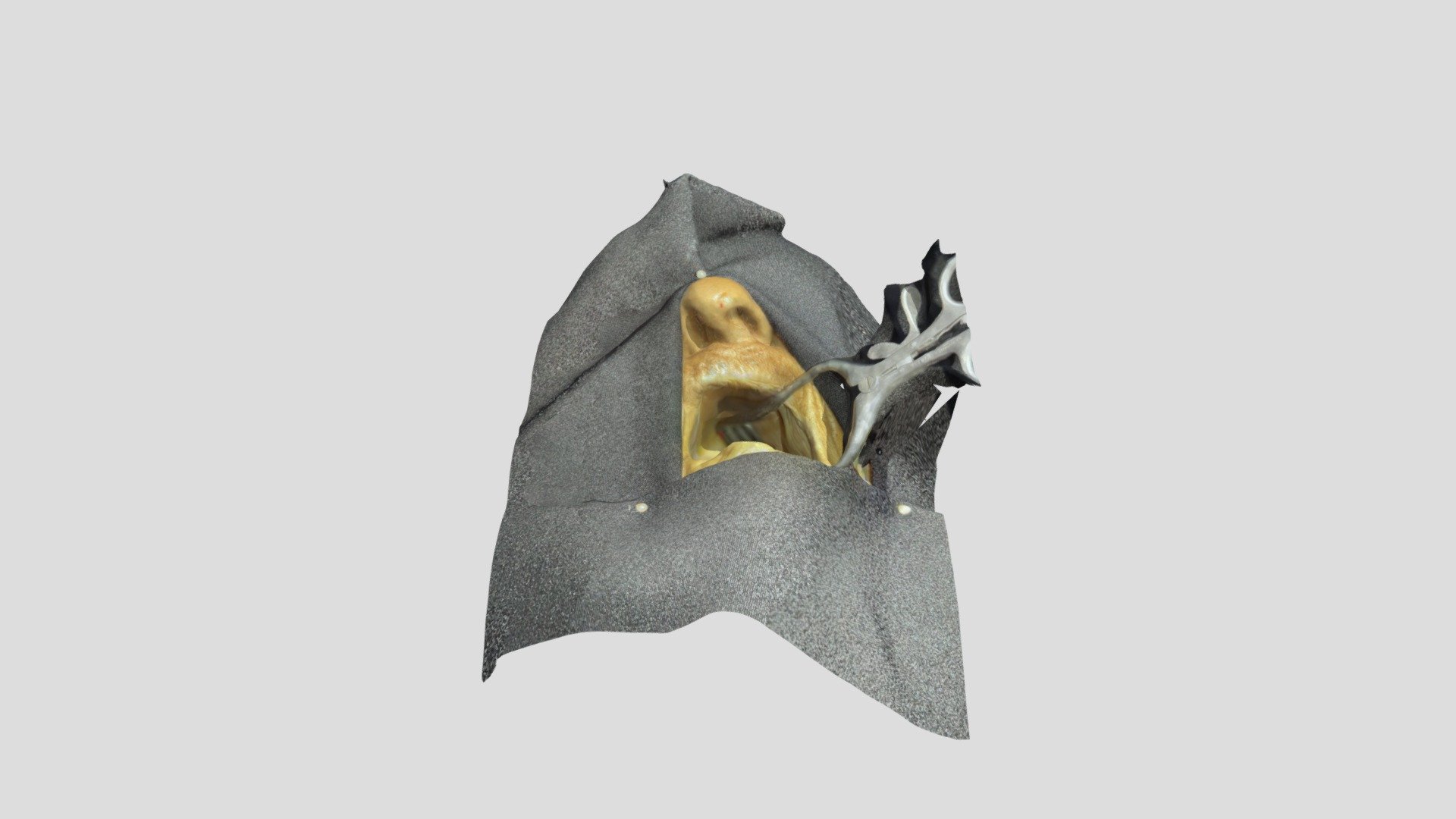 Transoral Approach Dura Exposure - 3D model by Istanbul ...