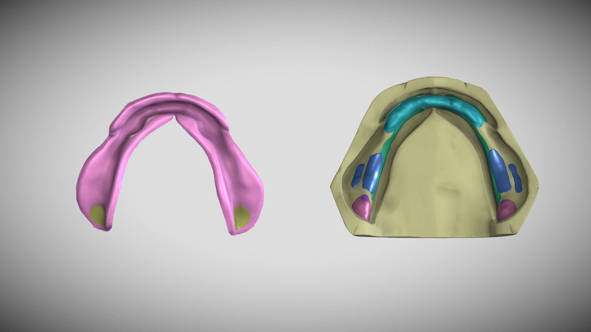 Mandibular Supporting Structures - 3D model by Muhammad Nabeel ...