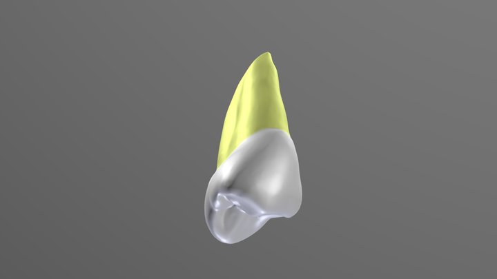 Maxillary 3D models - Sketchfab