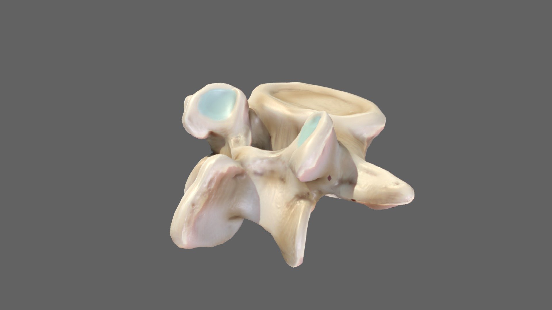 L5 Vertebra - Buy Royalty Free 3D model by Hannah Bryce Ely, CMI (@Hely ...