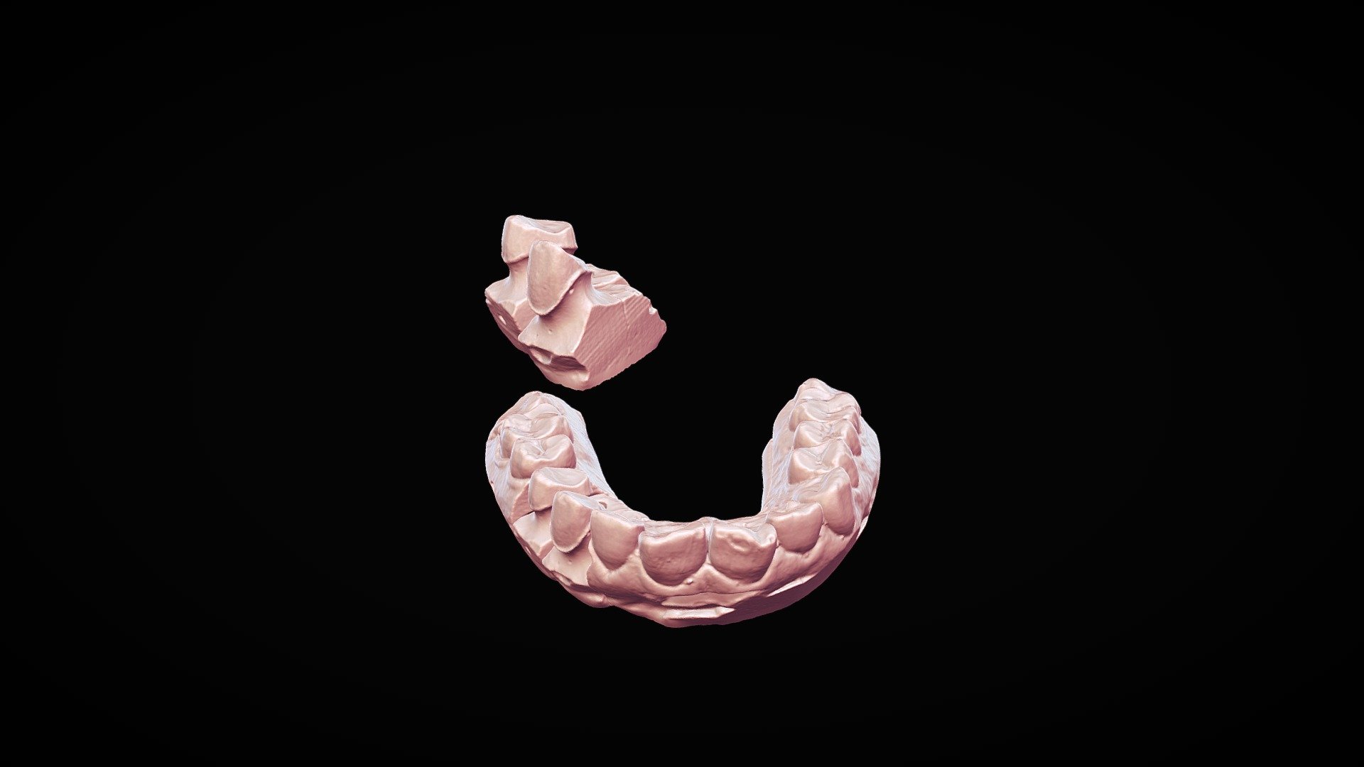 Seperated Denture - 3D model by thunk3d.scanner [8c612d1] - Sketchfab