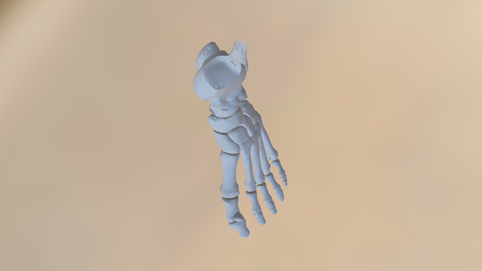 Foot Fracture - sku 165 - 3D model by orto3d [8c9e9c4] - Sketchfab