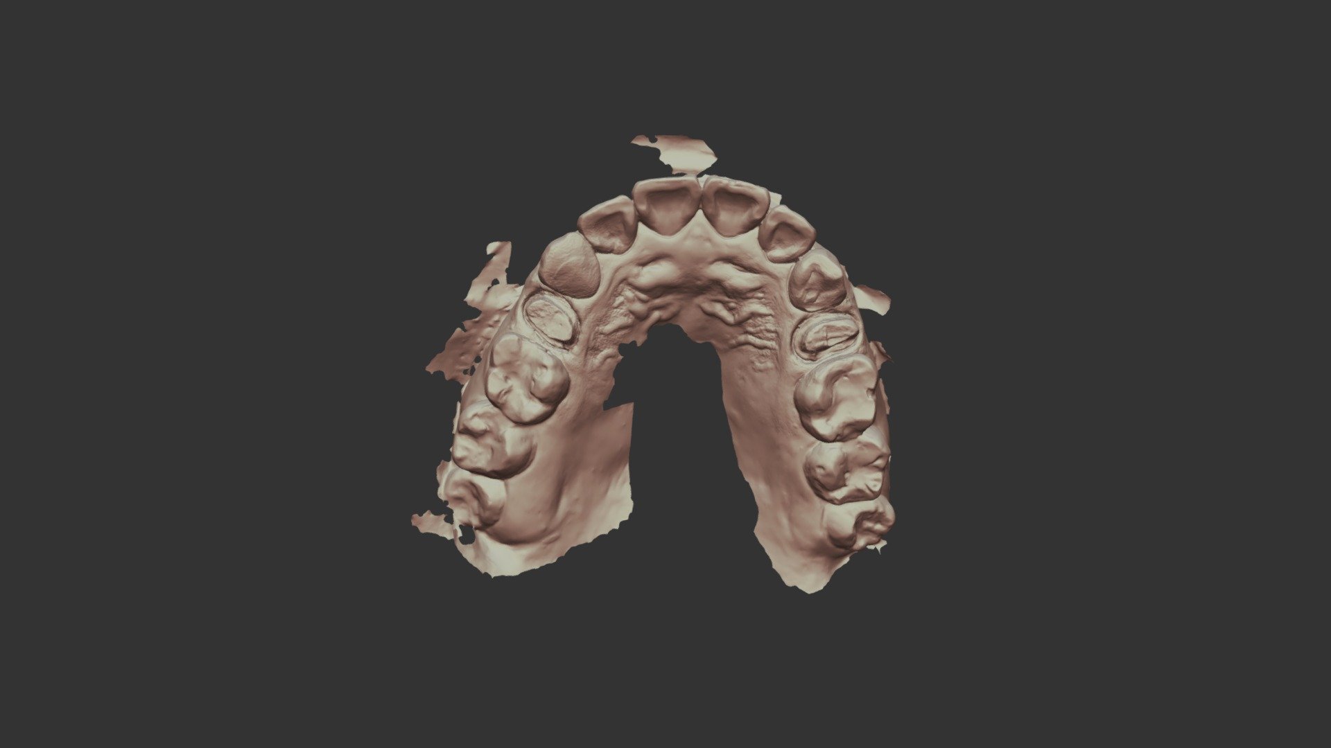 15,25 emax crown Upper Jaw Scan - 3D model by huweifan [8cbc2c3 ...