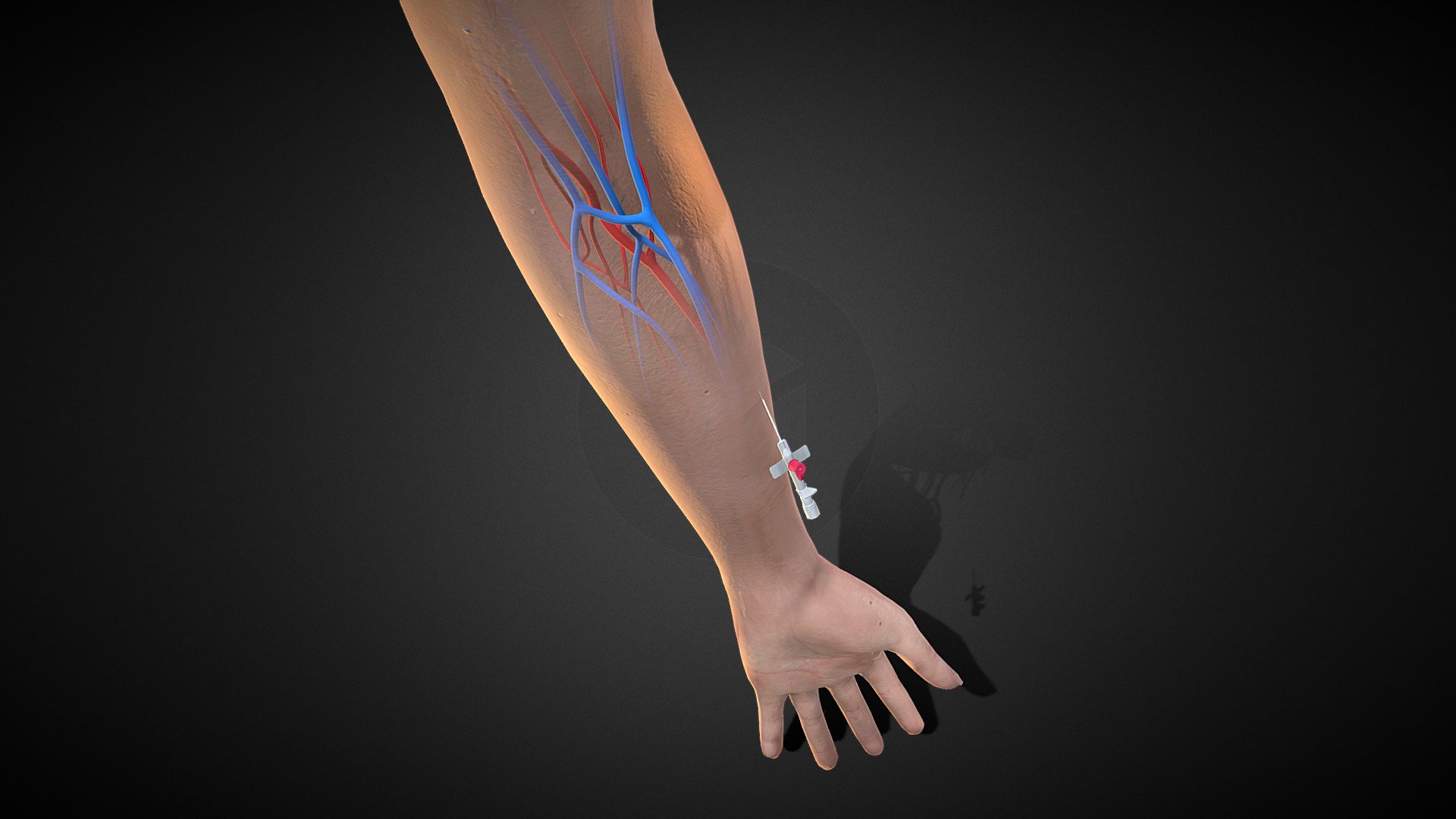 3D Injected Cannula with sticking plaster - Buy Royalty Free 3D model ...