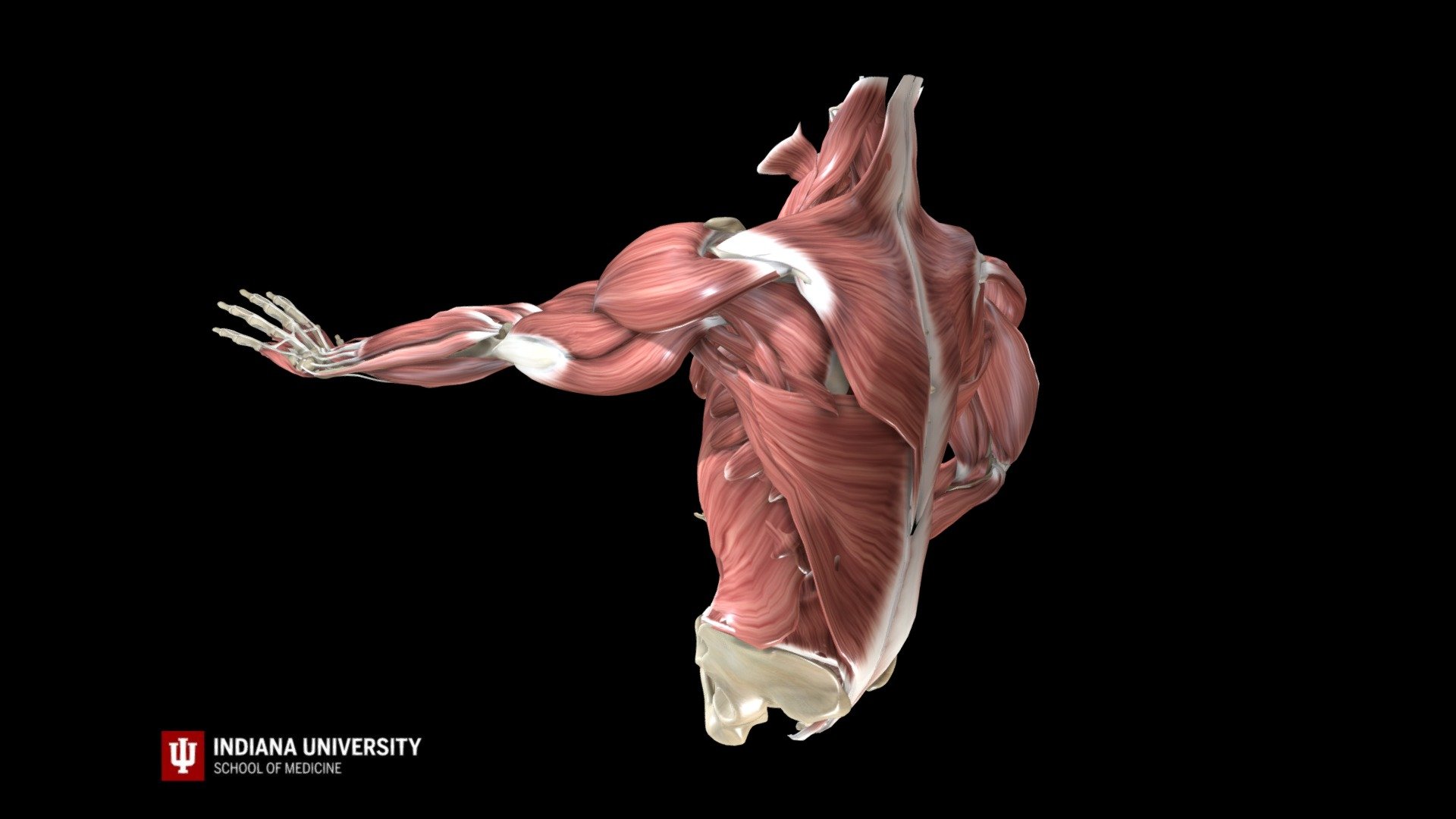 Shoulder - Impingement: Neer Exam - Male - 3D model by Dockive [8e9ea08 ...