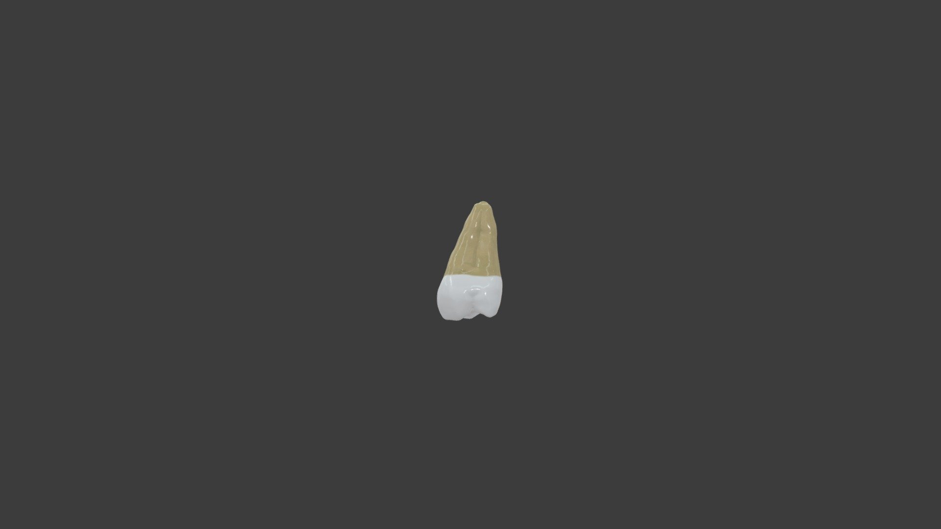 Maxillary 3rd Molar Left - 3D model by Ahmed Mahrous (@drahedmahrous ...