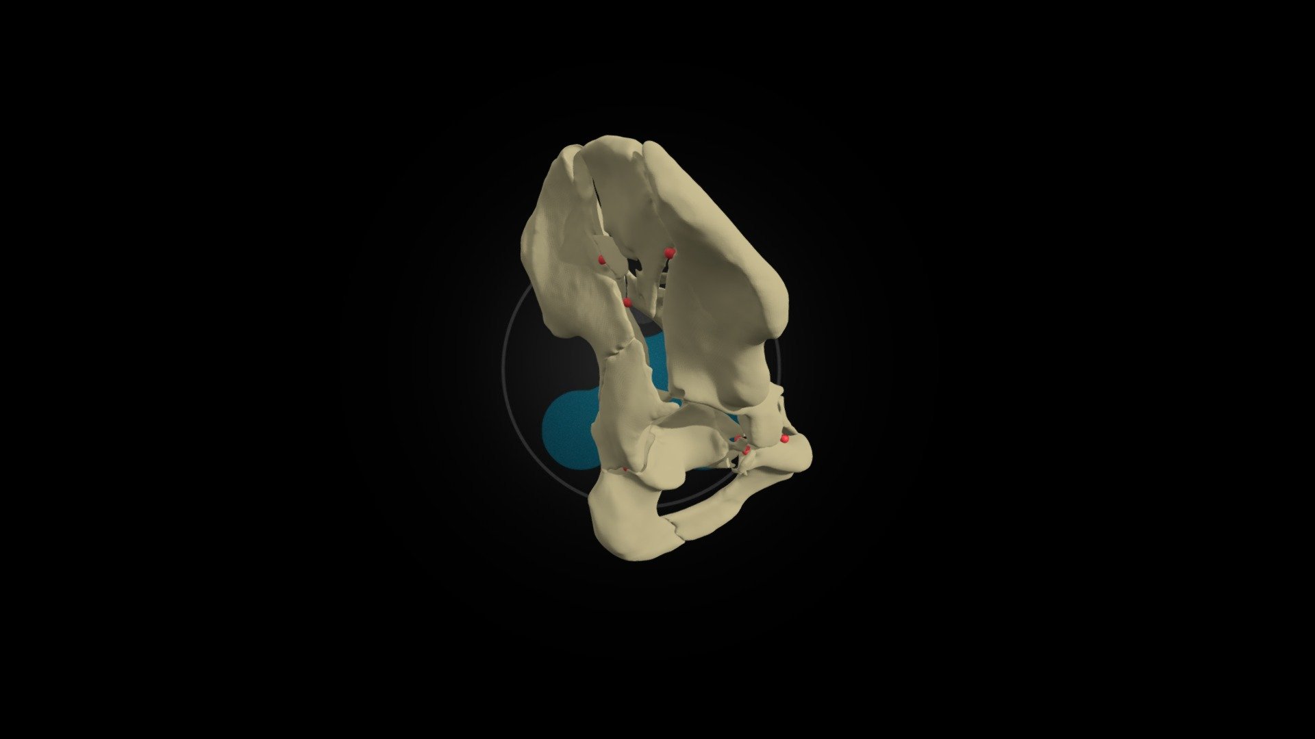 HumanX Acetabulum Fracture (m) right #002 - 3D model by HumanX Medical ...