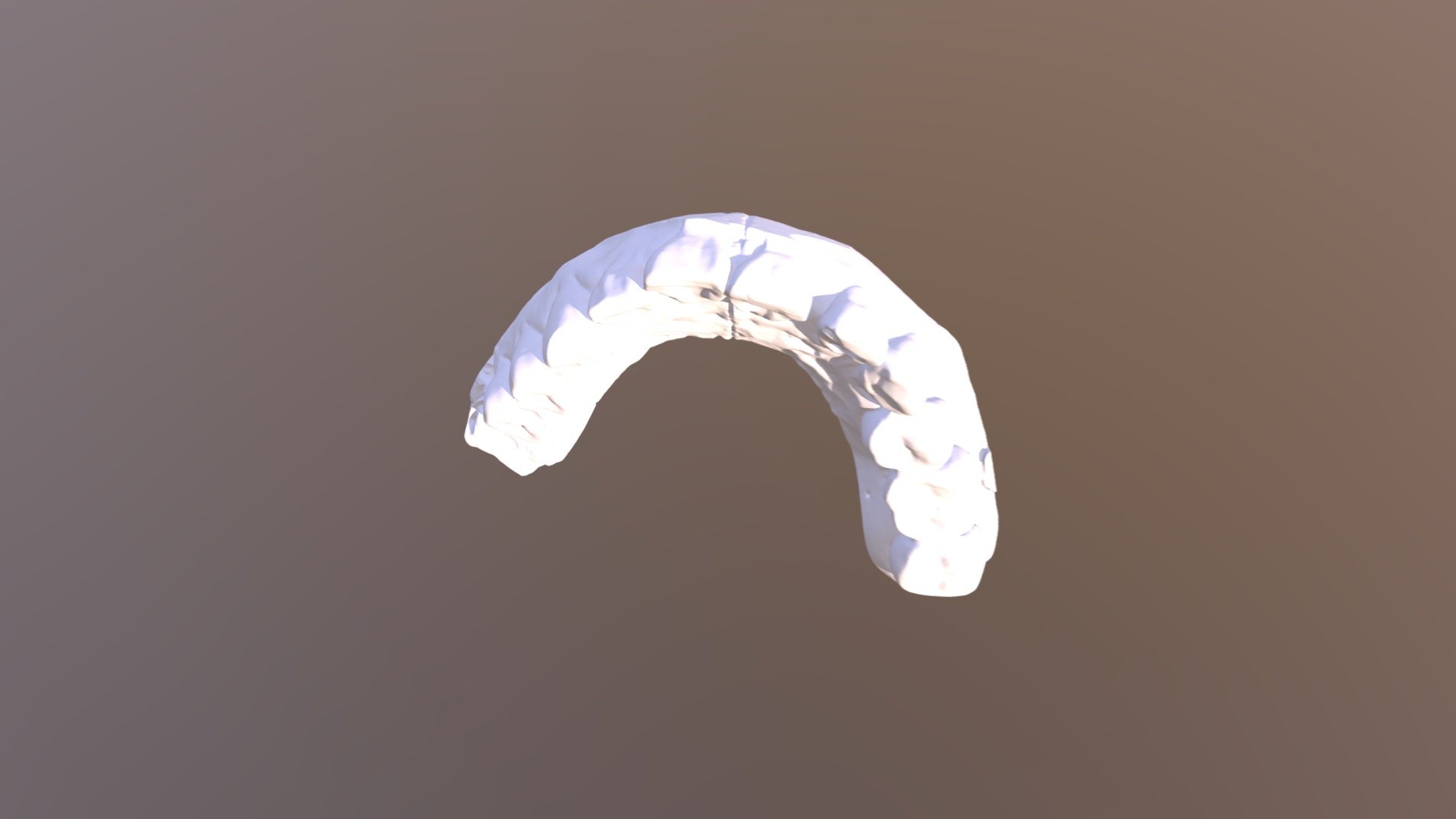 Preparation Scan - Download Free 3D model by maxall1177 [8f1c3d1 ...