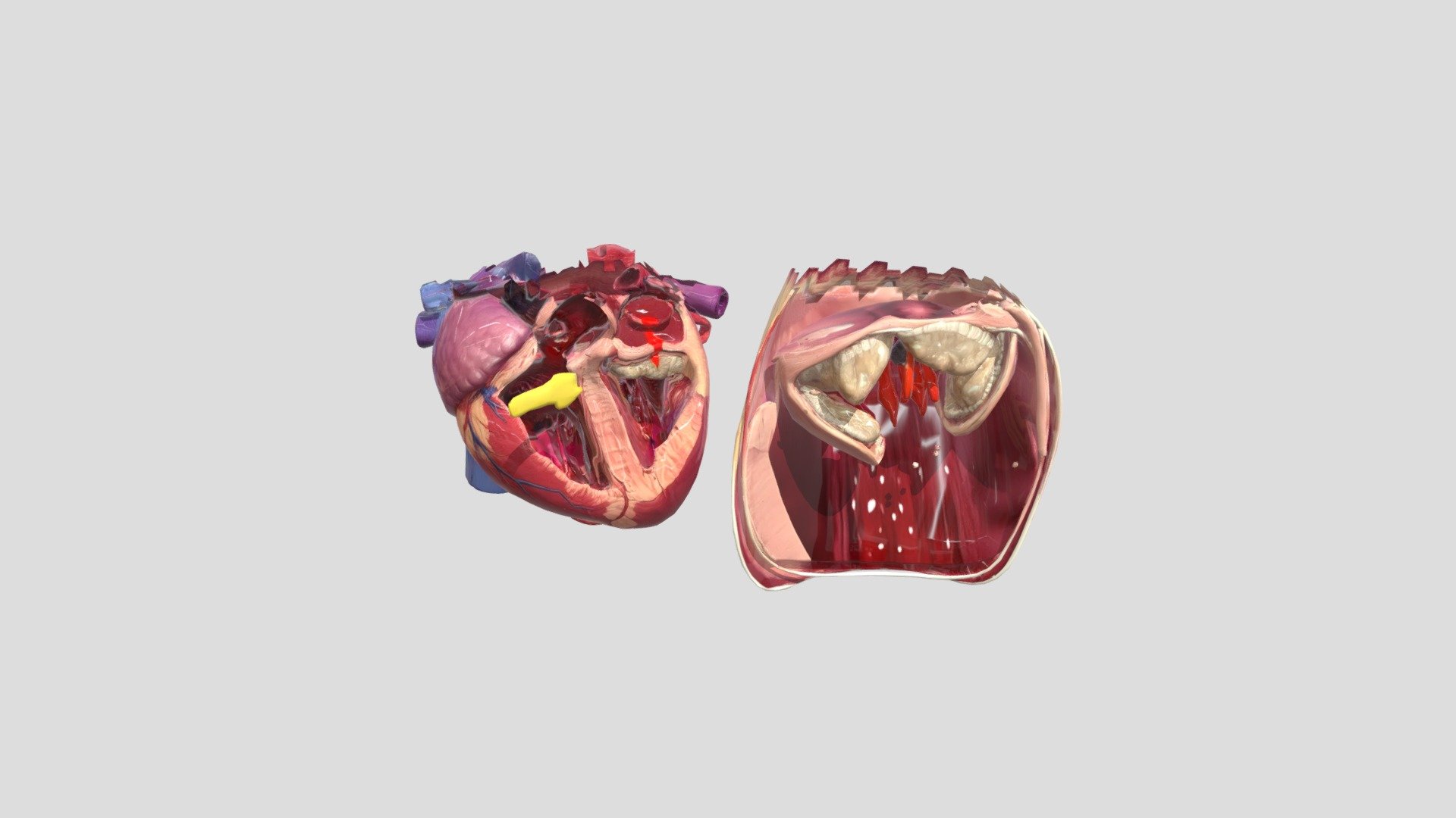 Heart Valve Defect 0.1 - 3D model by manee4340 [8f939bc] - Sketchfab
