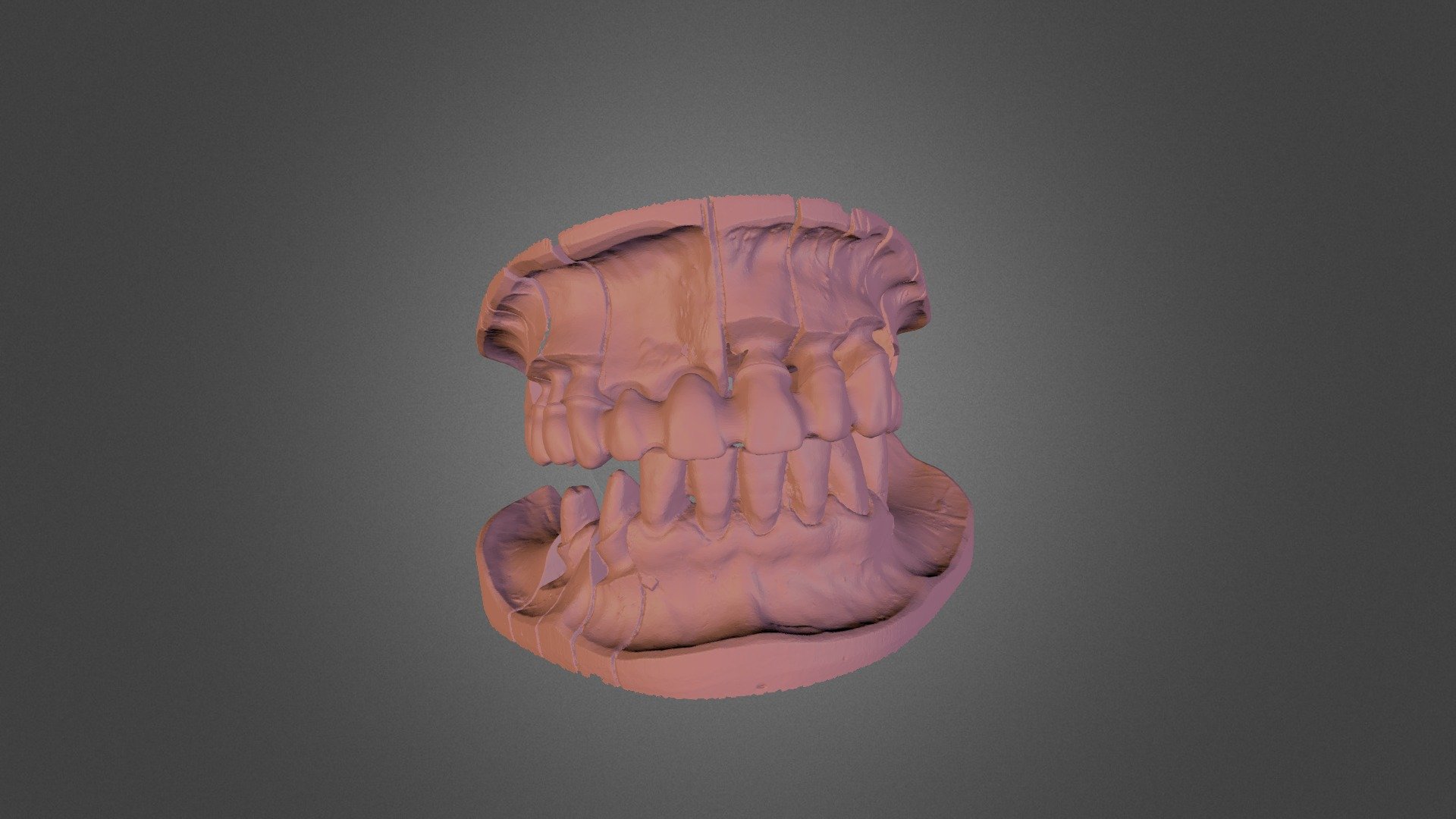 DSLM Co-Cr bridge - 3D model by CaptainMESH [905878a] - Sketchfab