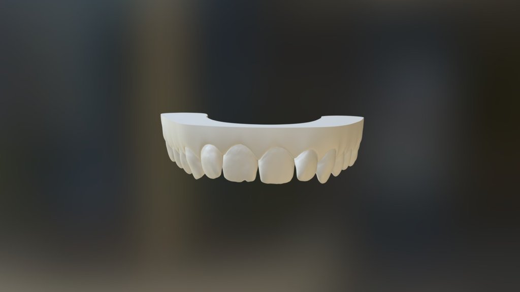 Invisalign (Start) - 3D model by profilodental [9064abb] - Sketchfab