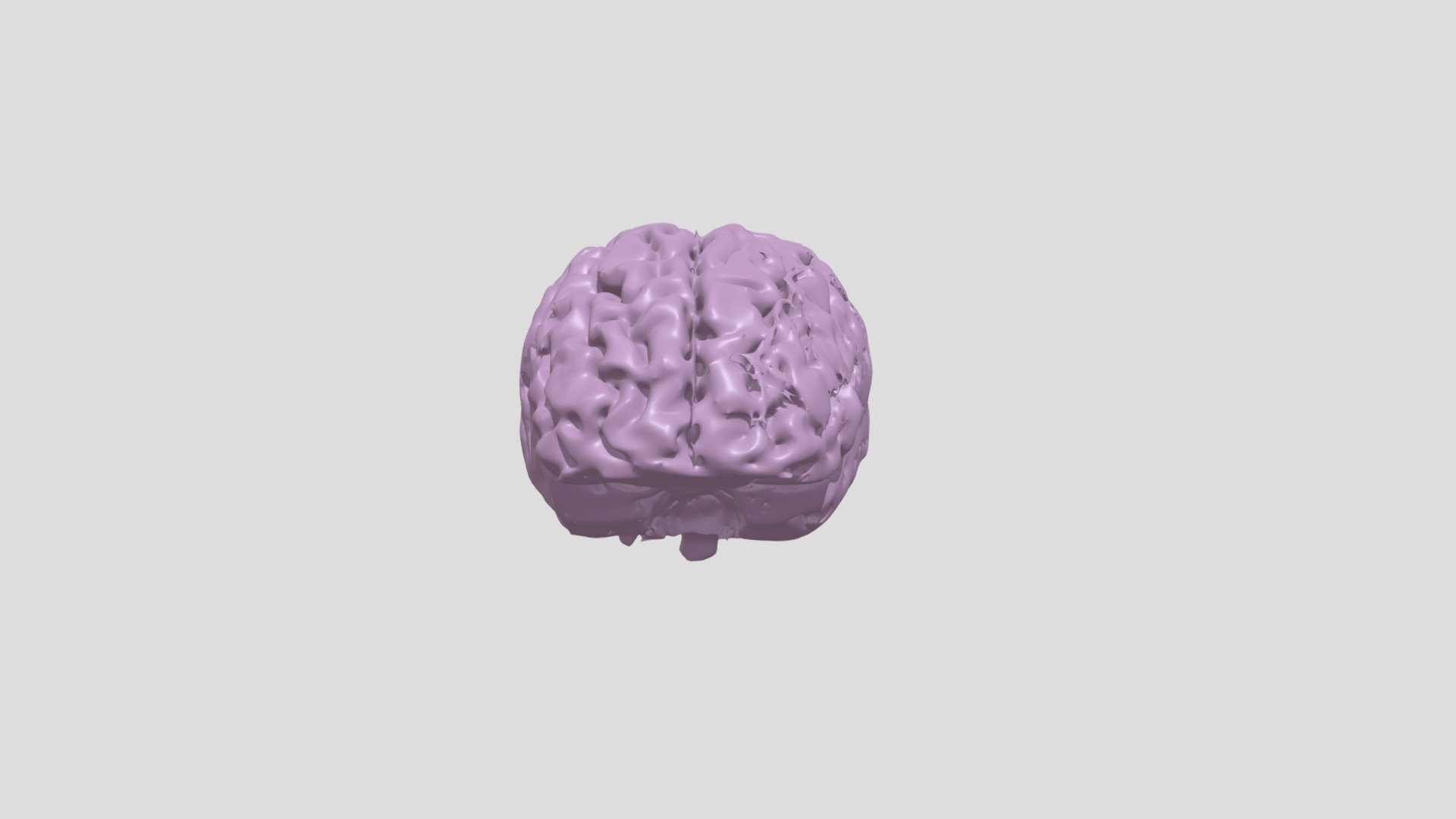 Edmund Evans_DICOM Selective_Brain 13_11_22 - 3D model by eevans ...