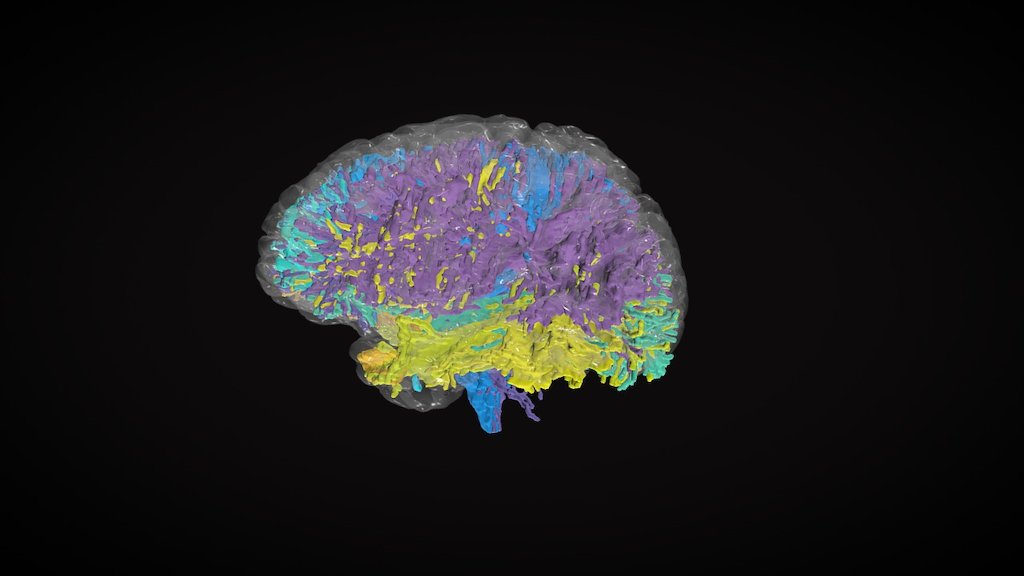 White Matter of the Brain with Cortical Surface - 3D model by ...