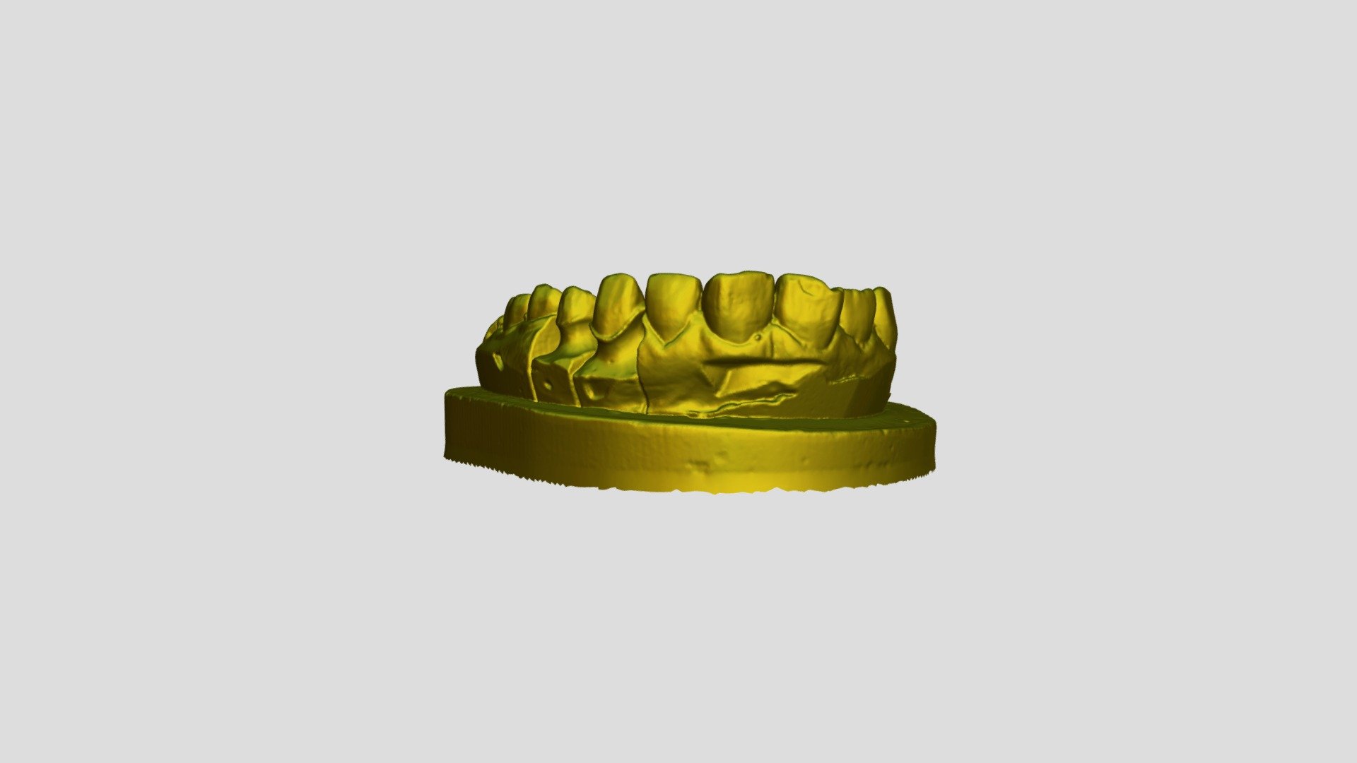 Denture Model - Download Free 3D model by Thunk3D 3D Scanner (@Lily ...