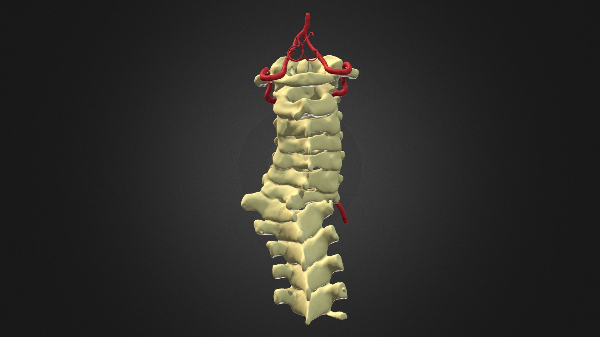 Cspine W Verts (hemivertebra) - 3D model by shinister [91dca55] - Sketchfab