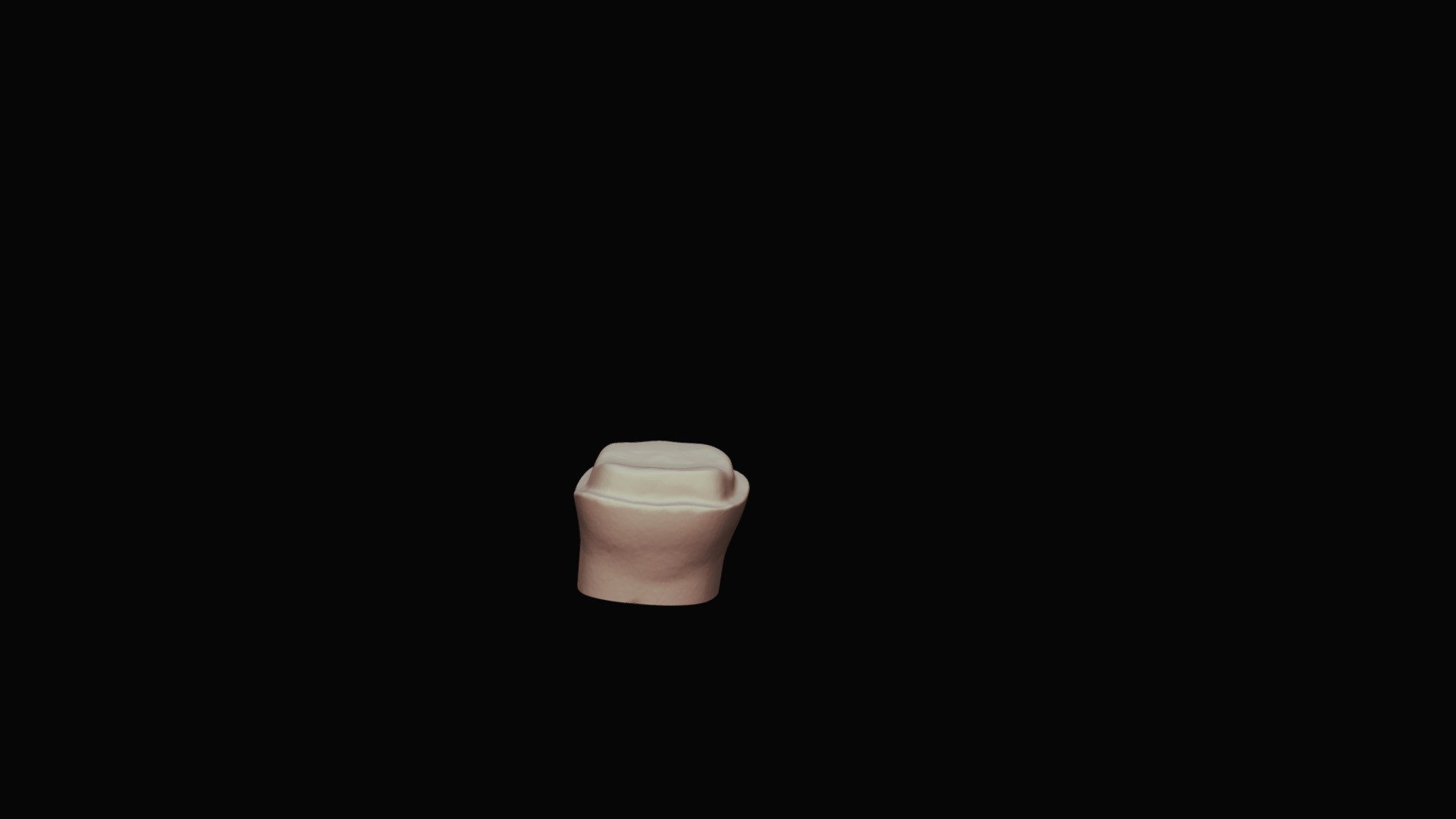 #19 Table-top ( Crownlay) - 3D model by VCU - Restorative Dentistry ...