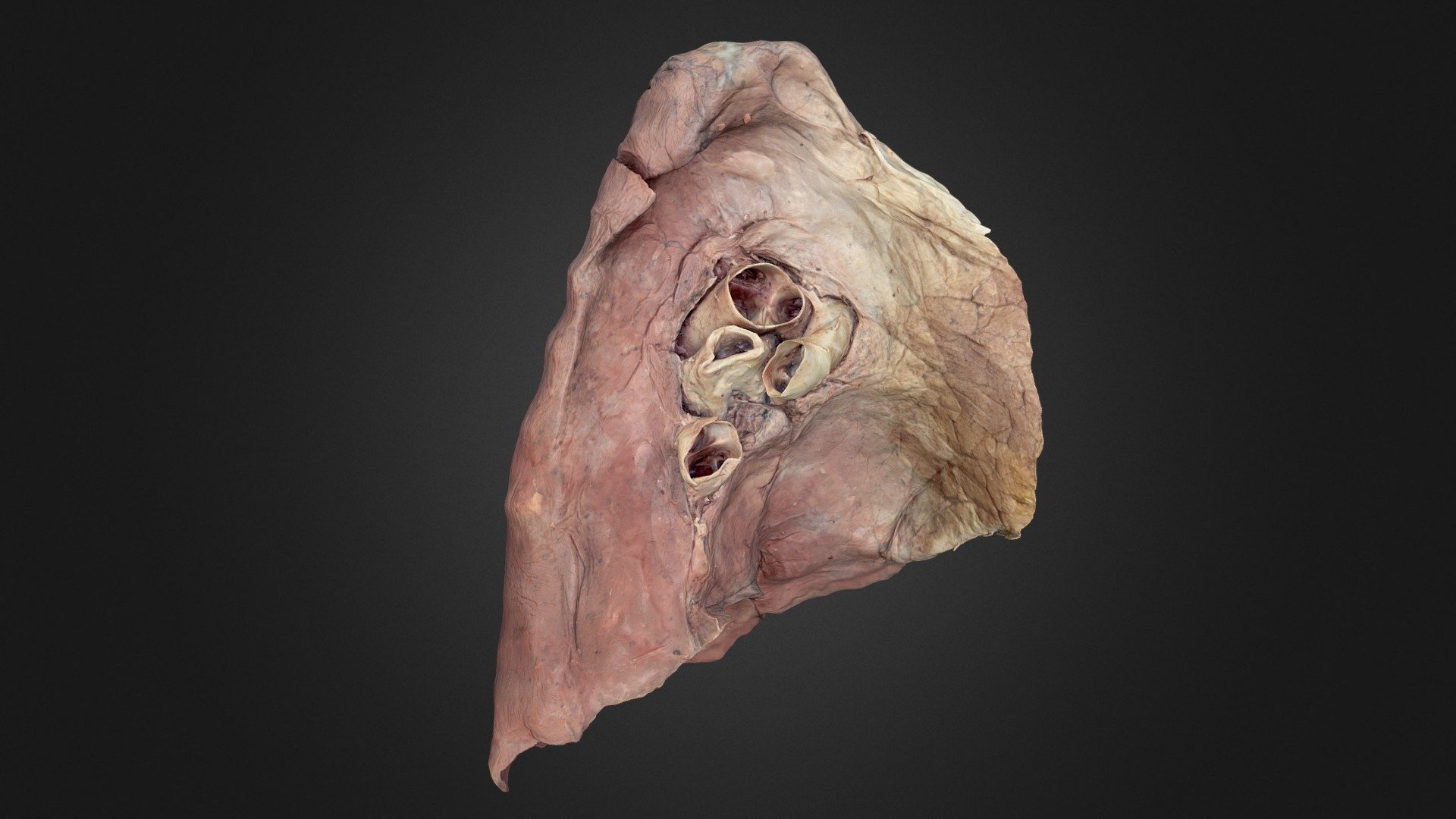 Left Lung - 3D model by UBC Medicine - Educational Media [92cb689 ...