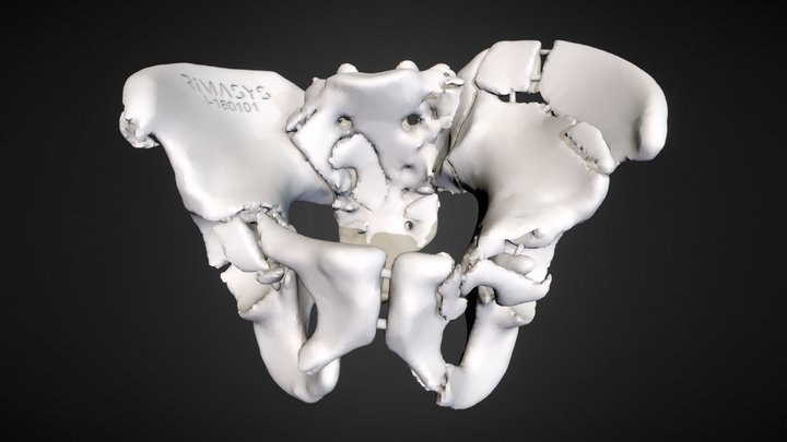 Acetabulum 3D models - Sketchfab