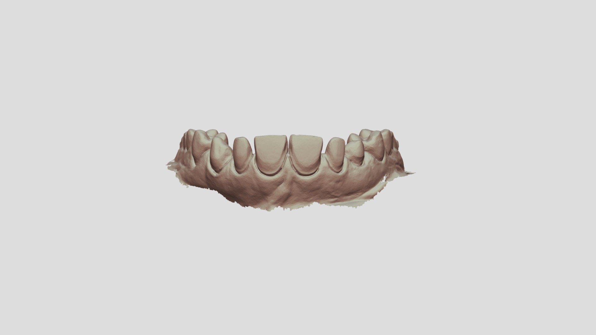 20230726 Upper Jaw Scan - Download Free 3D model by latte0126 [934db0d ...