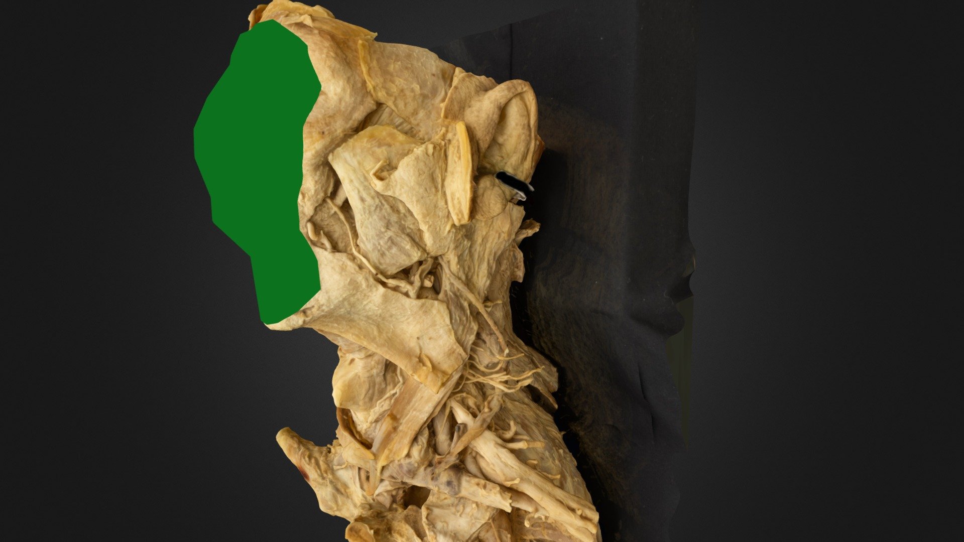 Muscles Of Mastication Superficial - 3D model by UBC Medicine ...