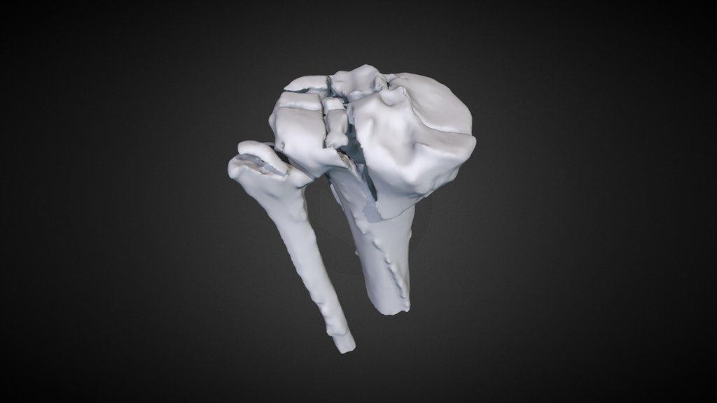 DKOU17 | #12 Proximal Tibia (C-170072-L) - 3D model by World Surgery ...