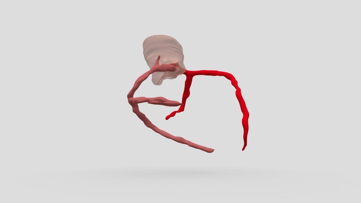 Coronary 3D models - Sketchfab