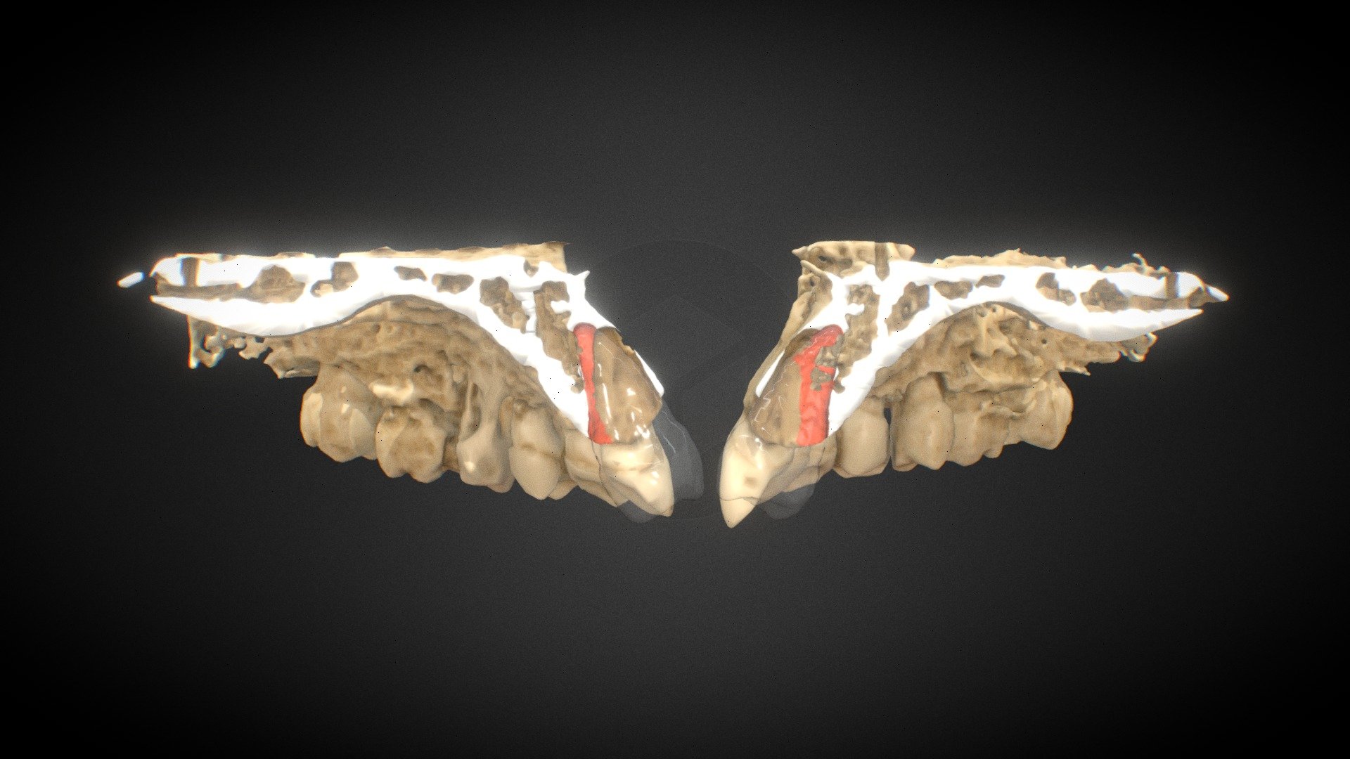 高謹瑜CBCT bone slice - 3D model by ProfeelLau [9403256] - Sketchfab